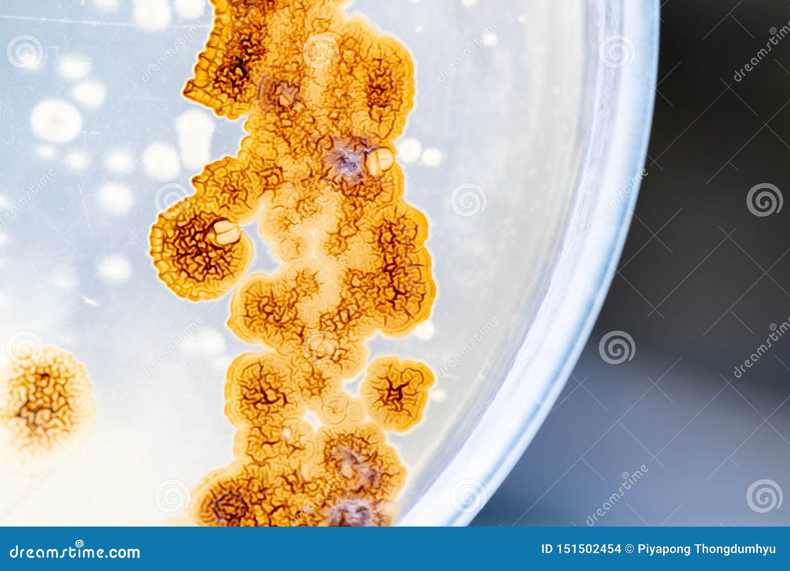 Characteristics and Different Shaped Colony of Bacteria and Mold ...