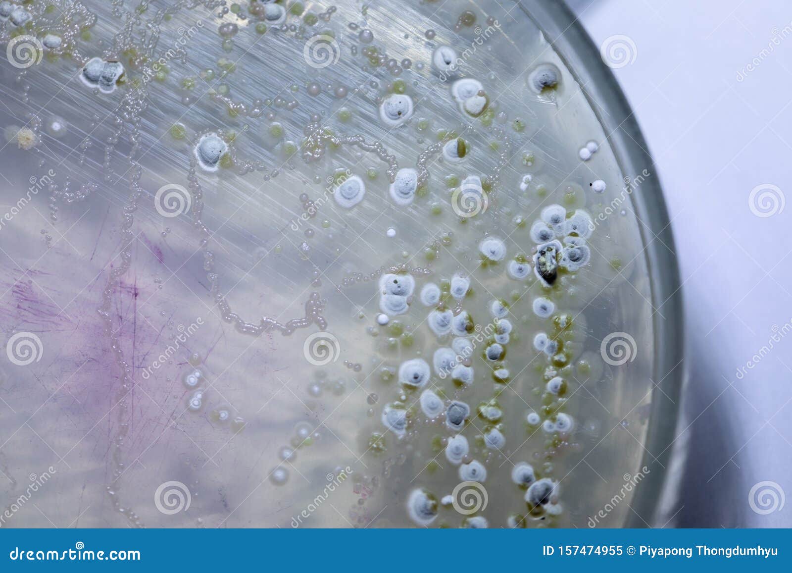 Characteristics and Different Shaped Colony of Bacteria and Mold ...
