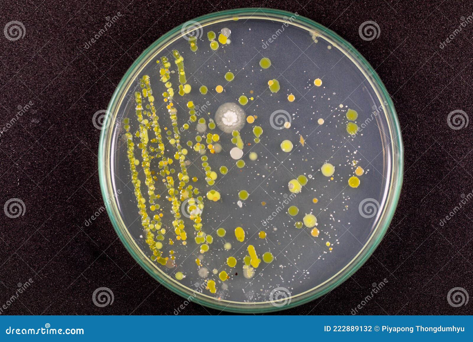 Characteristics and Different Shaped Colony of Bacteria and Mold ...