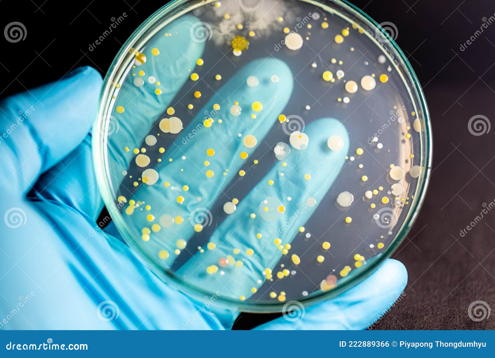 Characteristics and Different Shaped Colony of Bacteria and Mold ...