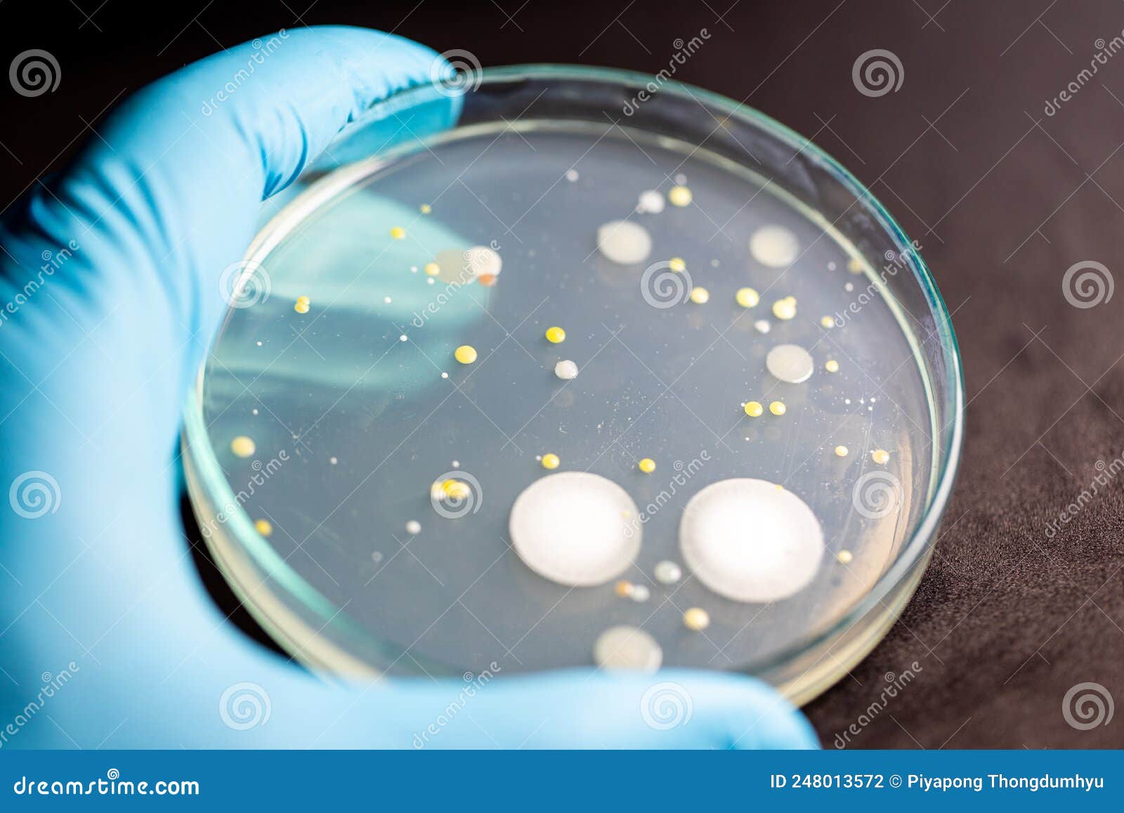 Characteristics and Different Shaped Colony of Bacteria and Mold ...