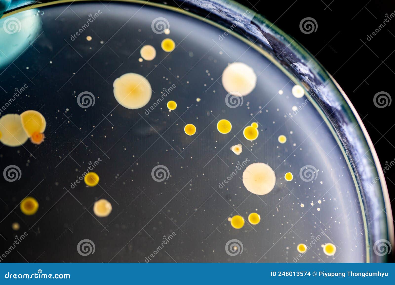 Characteristics and Different Shaped Colony of Bacteria and Mold ...