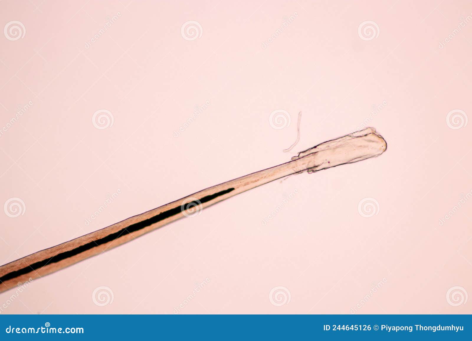 Hair Cell of Human Under Microscope View. Stock Photo - Image of loss ...