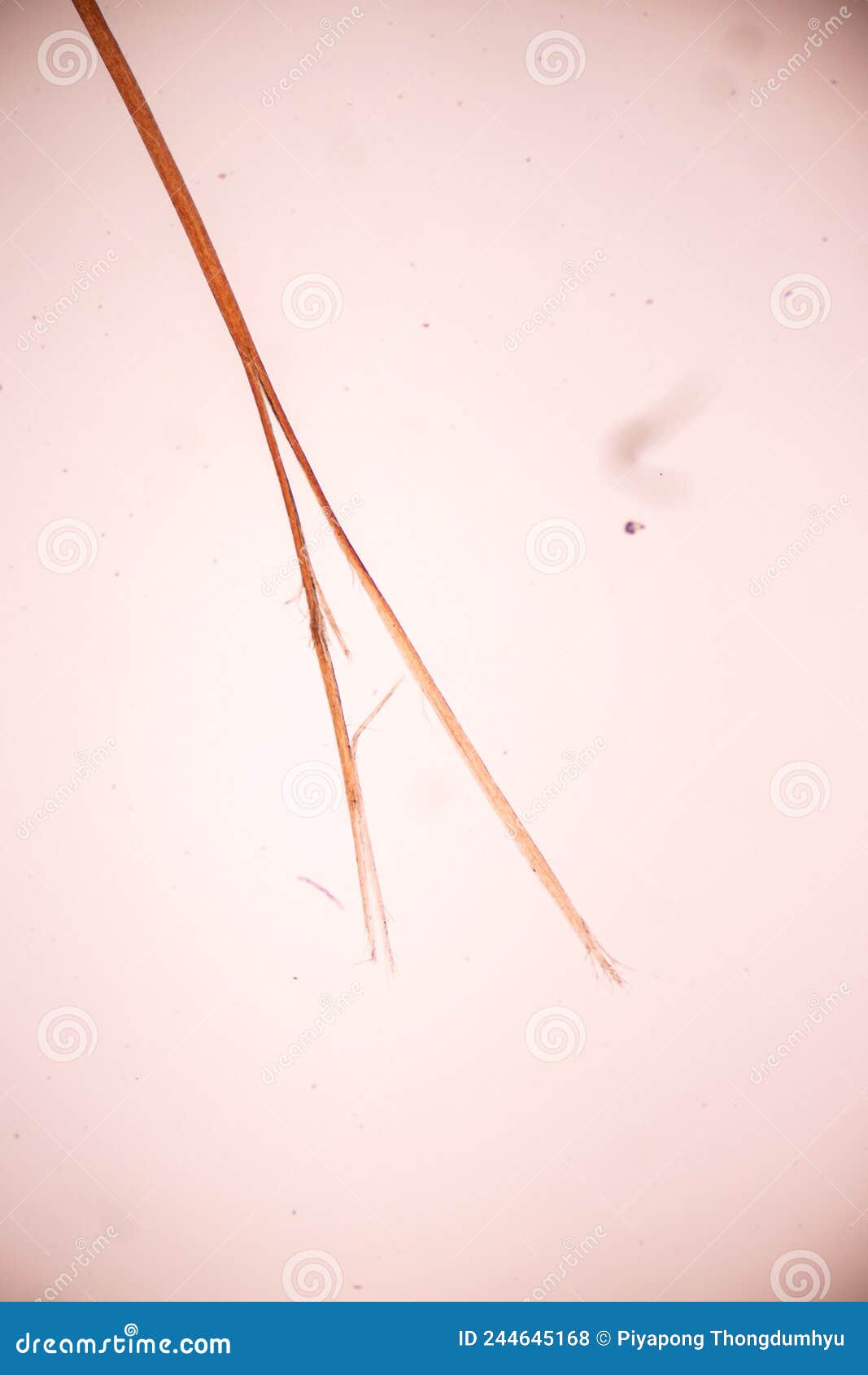 Hair Cell of Human Under Microscope View. Stock Photo - Image of dermis ...