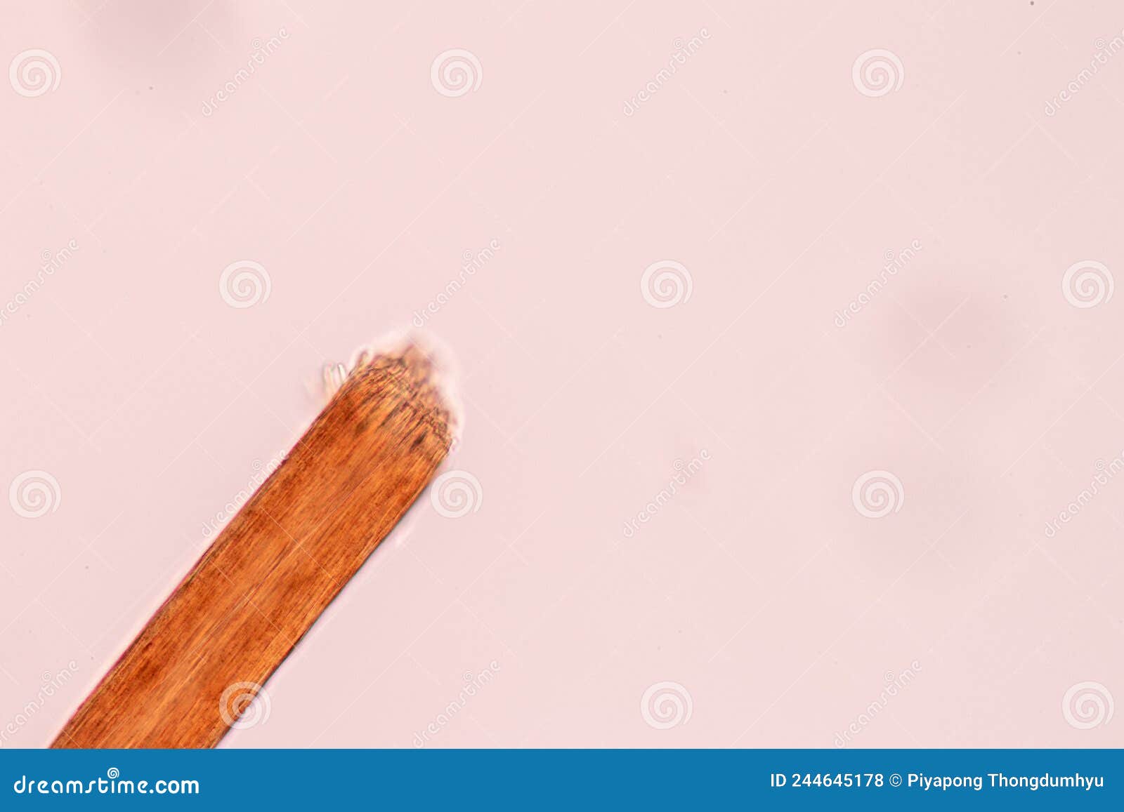 Hair Cell of Human Under Microscope View. Stock Photo - Image of ...