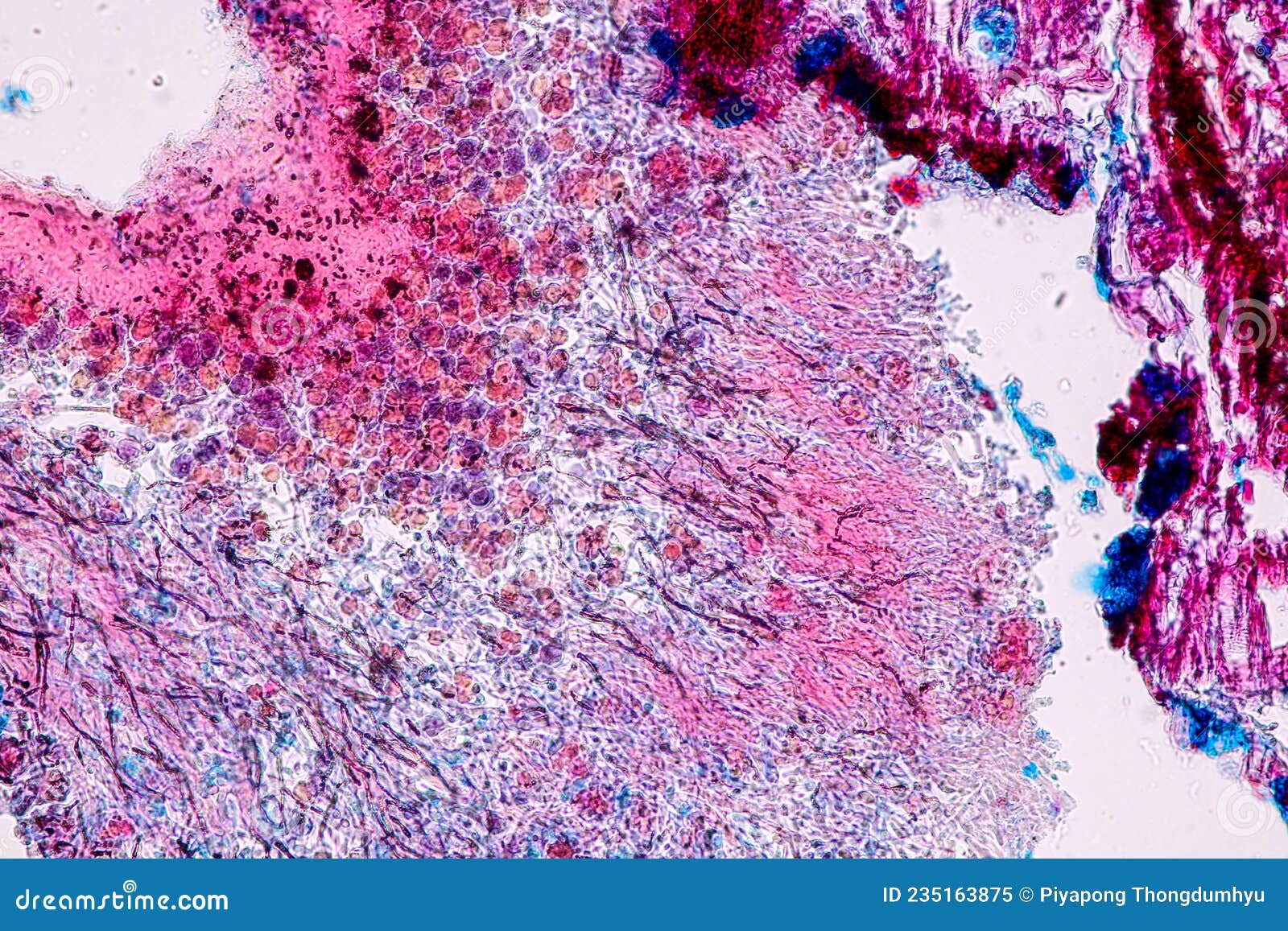 Lichen, Hyphae And Symbiotic Algae Under The Microscope For Education ...