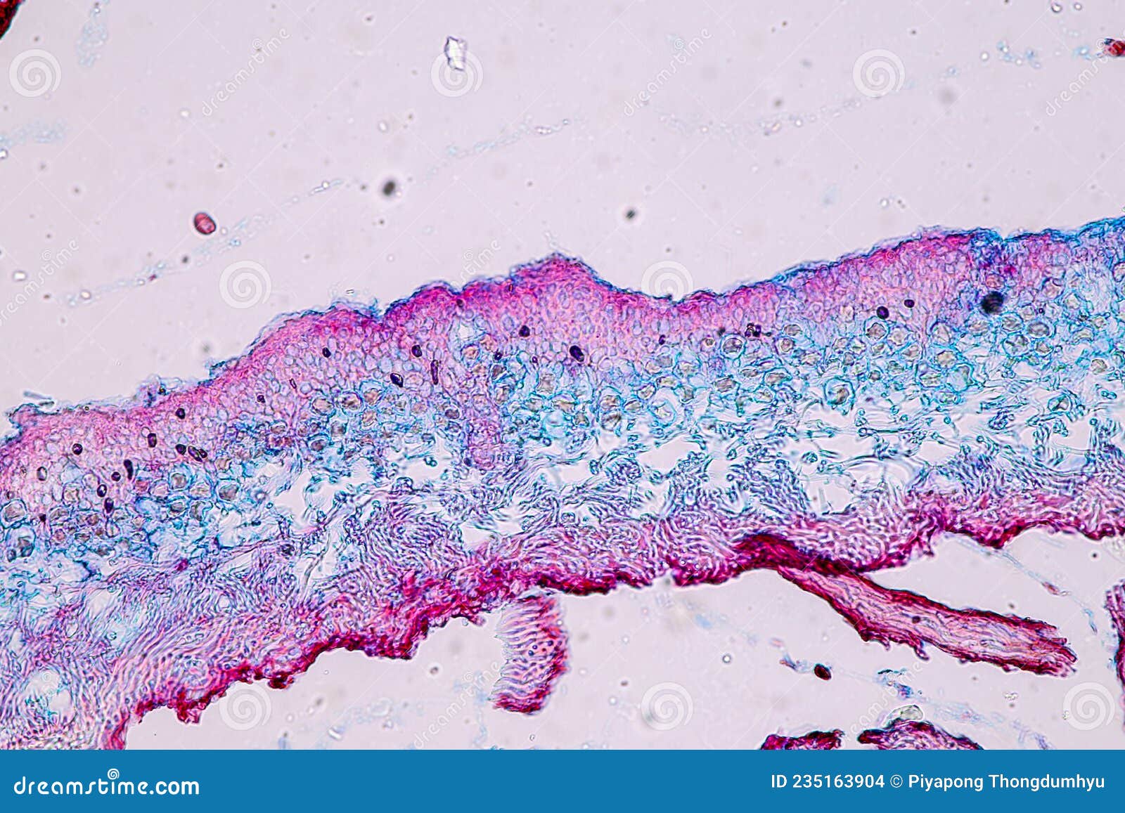 Lichen, Hyphae And Symbiotic Algae Under The Microscope For Education ...