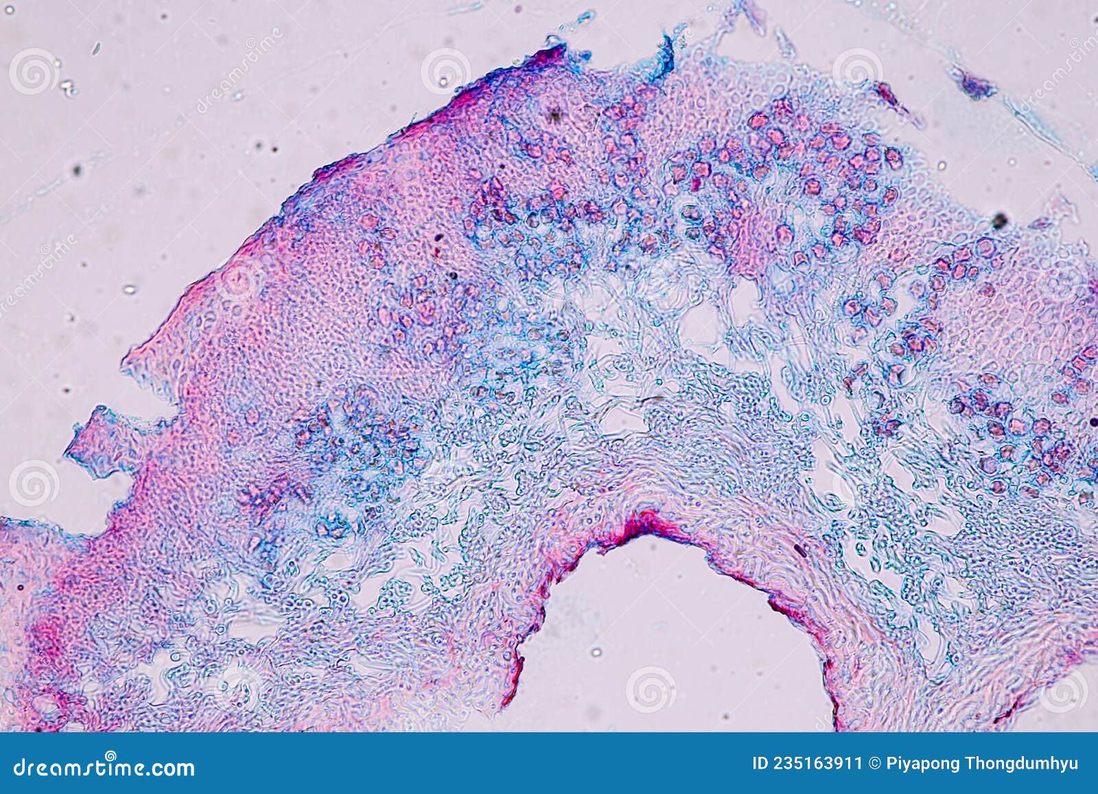 Lichen, Hyphae and Symbiotic Algae Under the Microscope for Education ...
