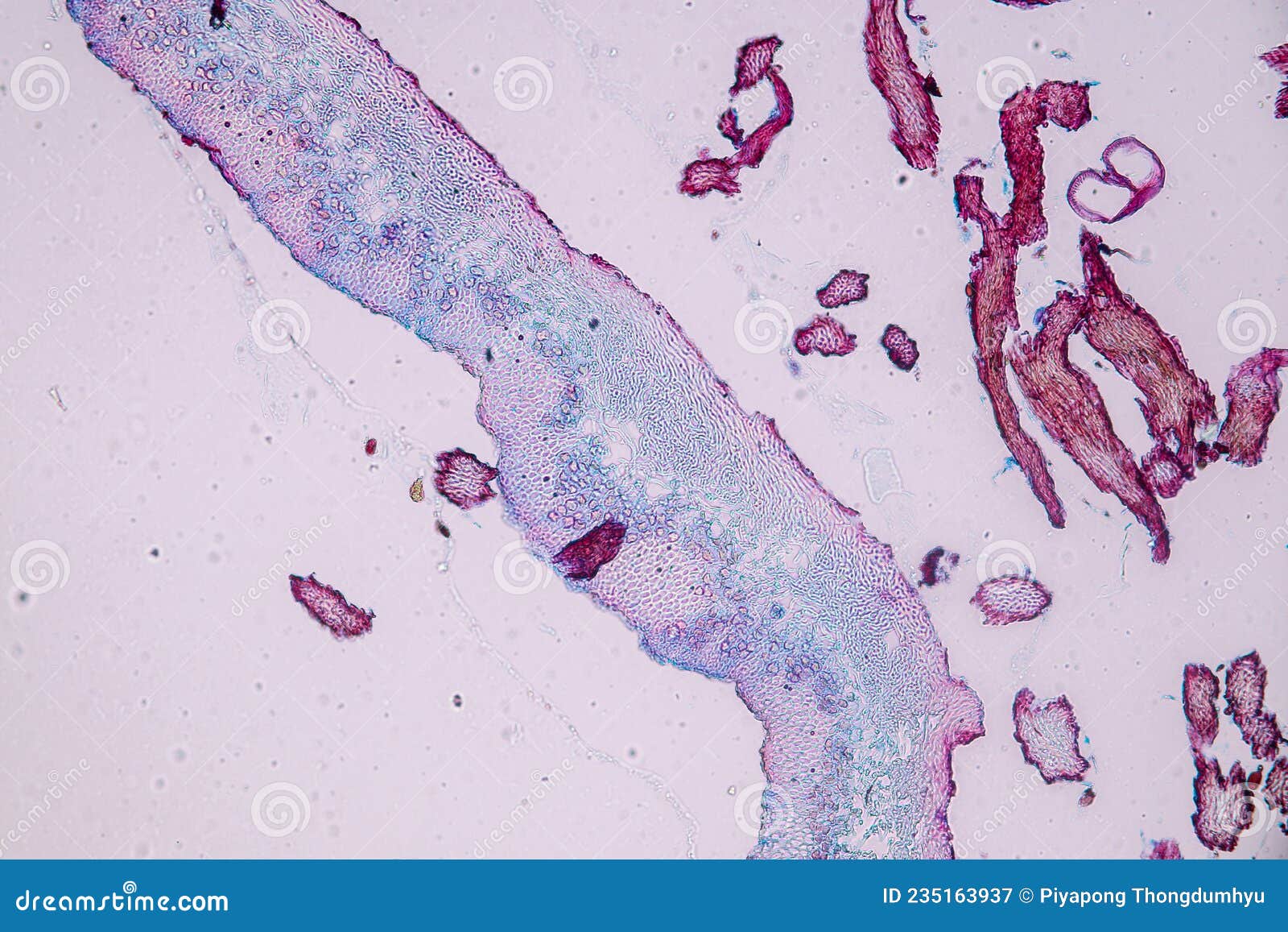 Lichen, Hyphae and Symbiotic Algae Under the Microscope for Education ...