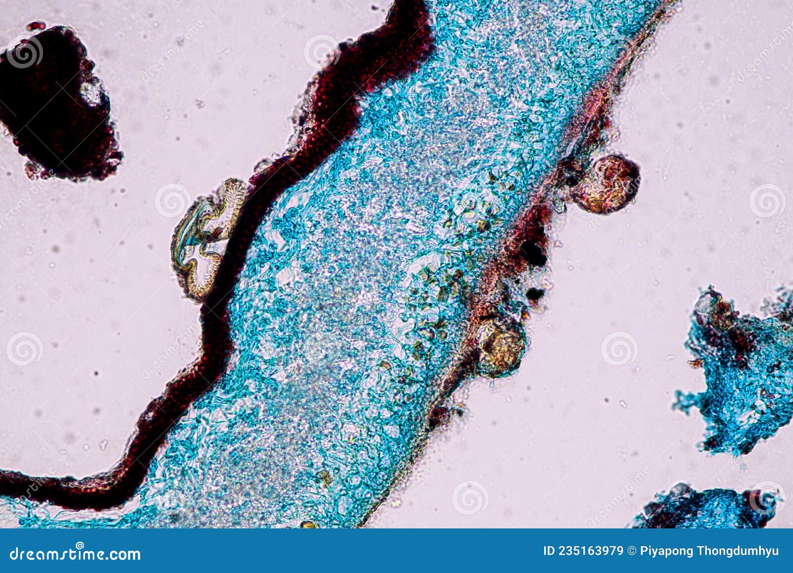 Lichen, Hyphae and Symbiotic Algae Under the Microscope for Education ...