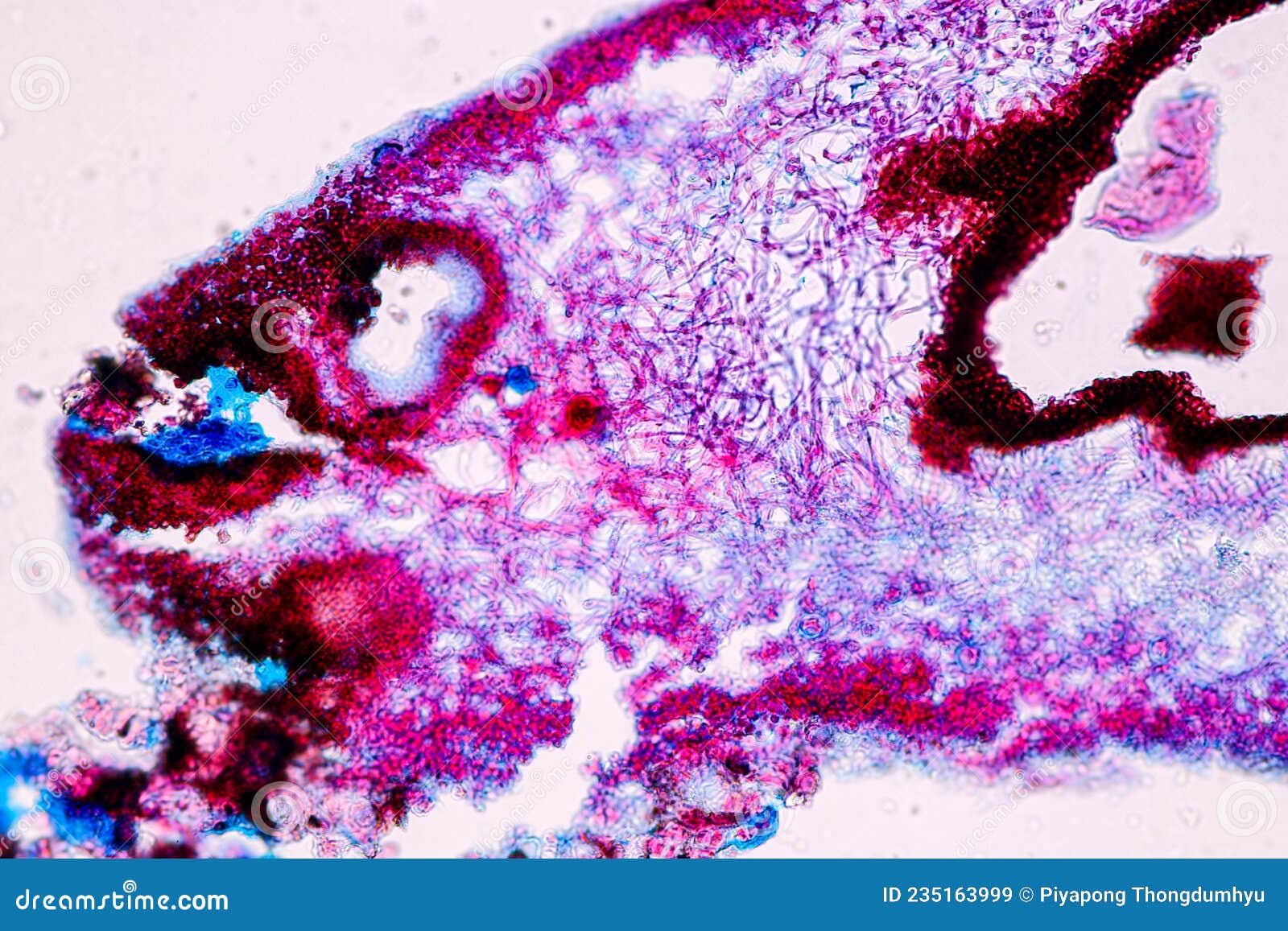 Lichen, Hyphae and Symbiotic Algae Under the Microscope for Education ...