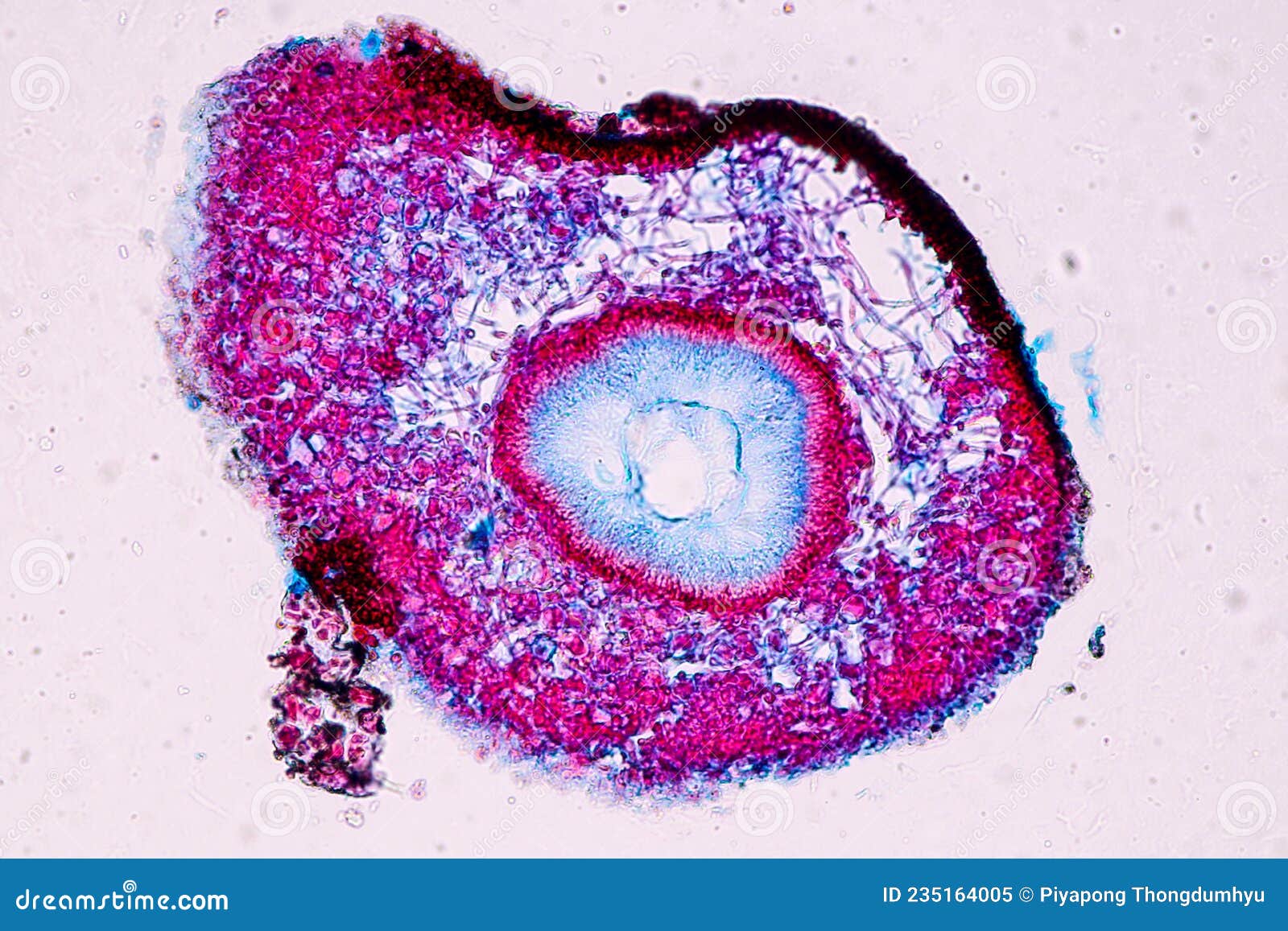 Lichen, Hyphae and Symbiotic Algae Under the Microscope for Education ...