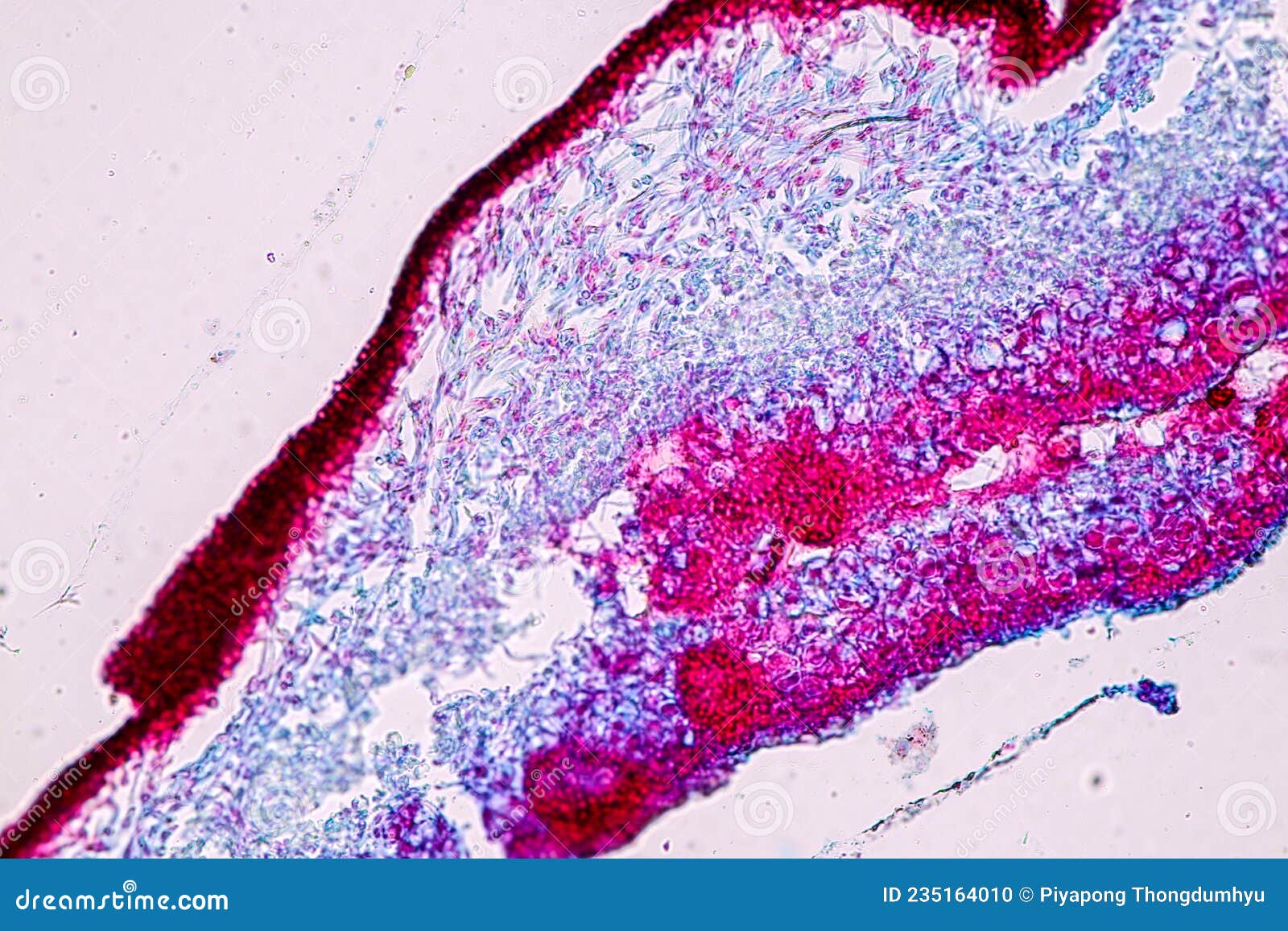 Lichen, Hyphae and Symbiotic Algae Under the Microscope for Education ...