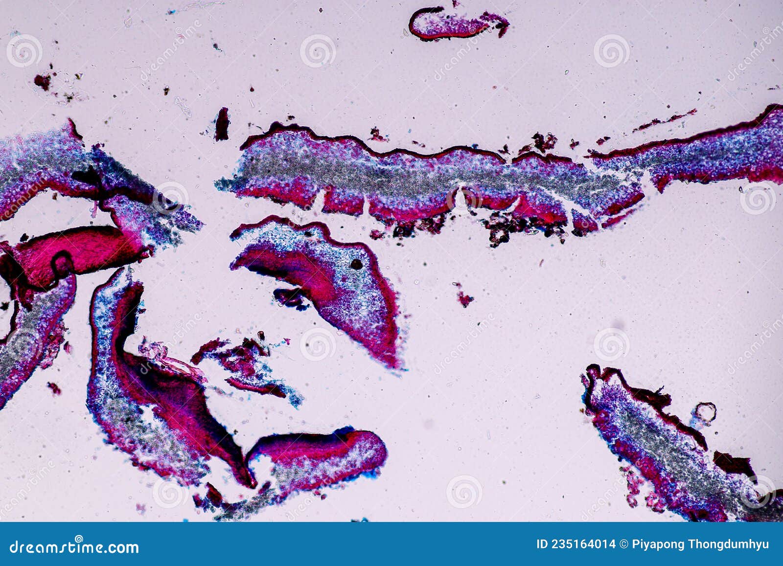 Lichen, Hyphae and Symbiotic Algae Under the Microscope for Education ...