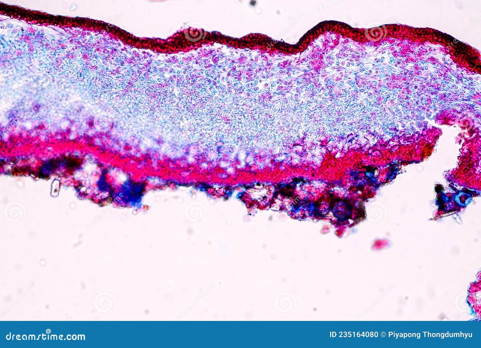Lichen Thallus Cross Section