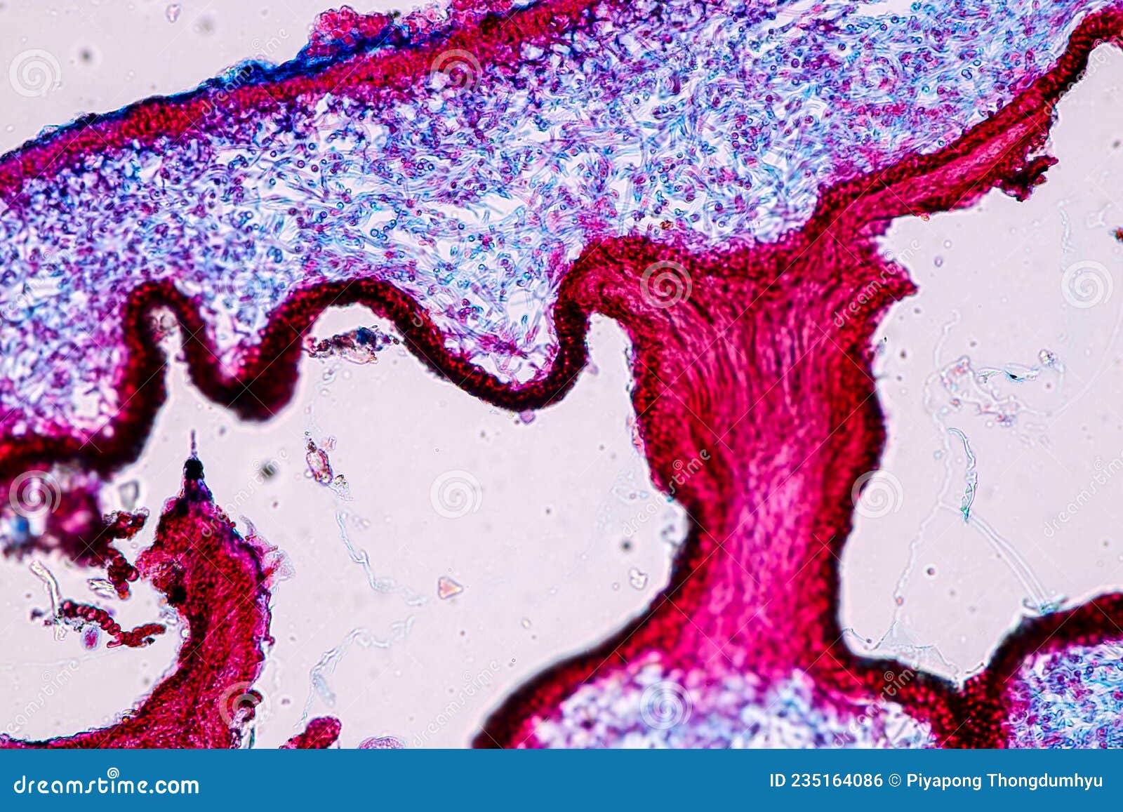 Lichen, Hyphae and Symbiotic Algae Under the Microscope for Education ...