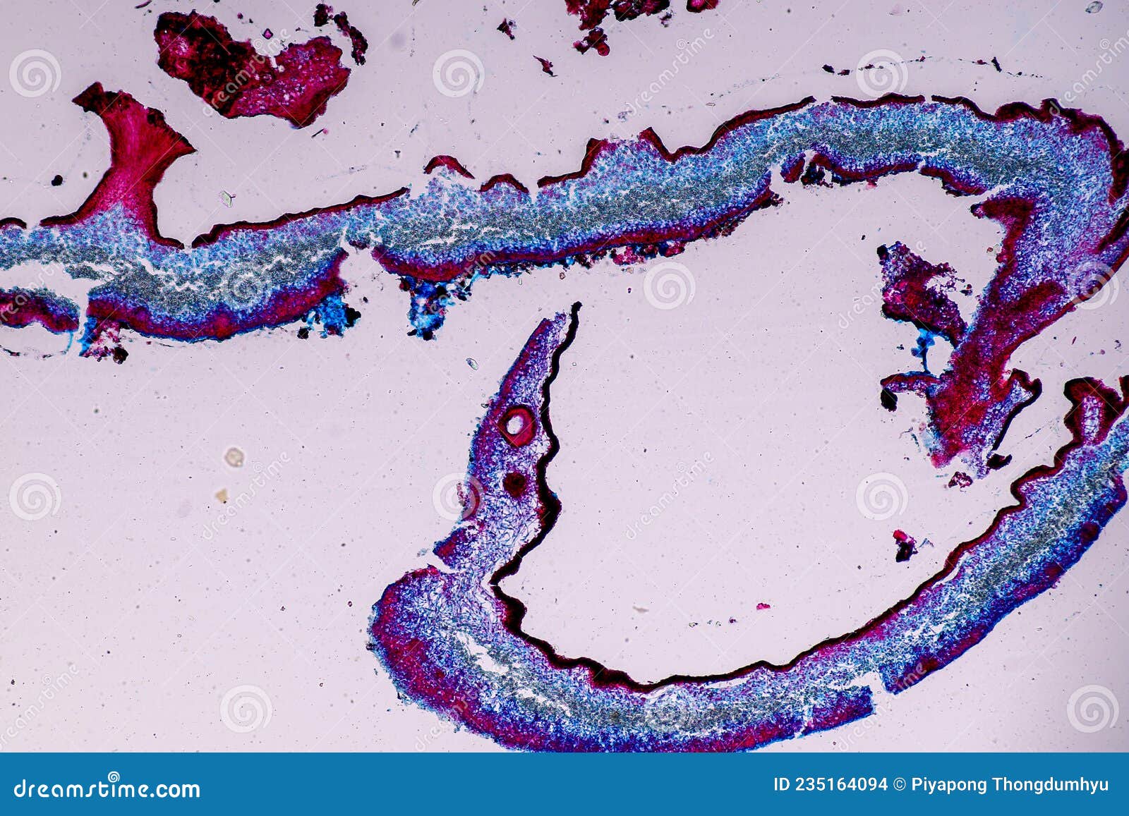 Lichen, Hyphae and Symbiotic Algae Under the Microscope for Education ...