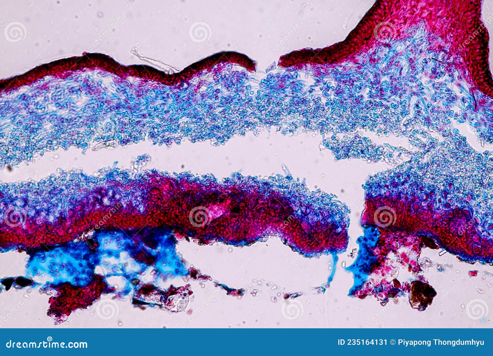 Lichen, Hyphae and Symbiotic Algae Under the Microscope for Education ...
