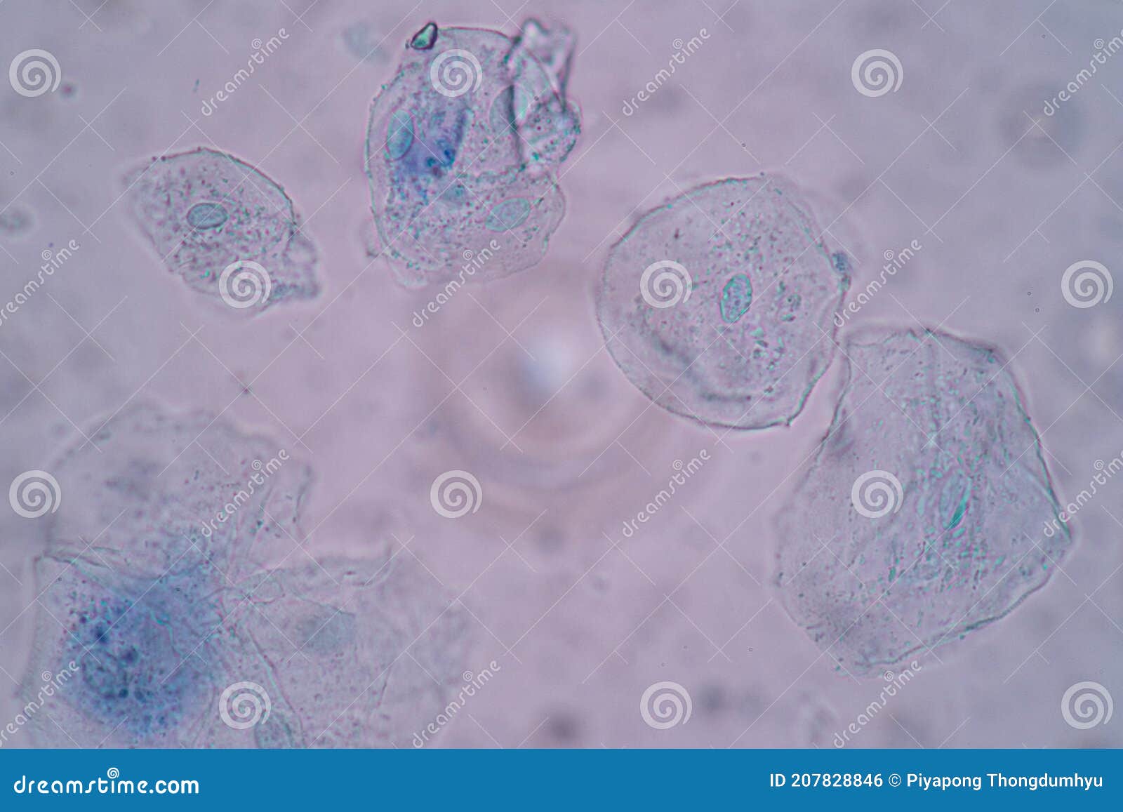 Characteristics of Squamous Epithelial Cell Cell Structure of Human ...