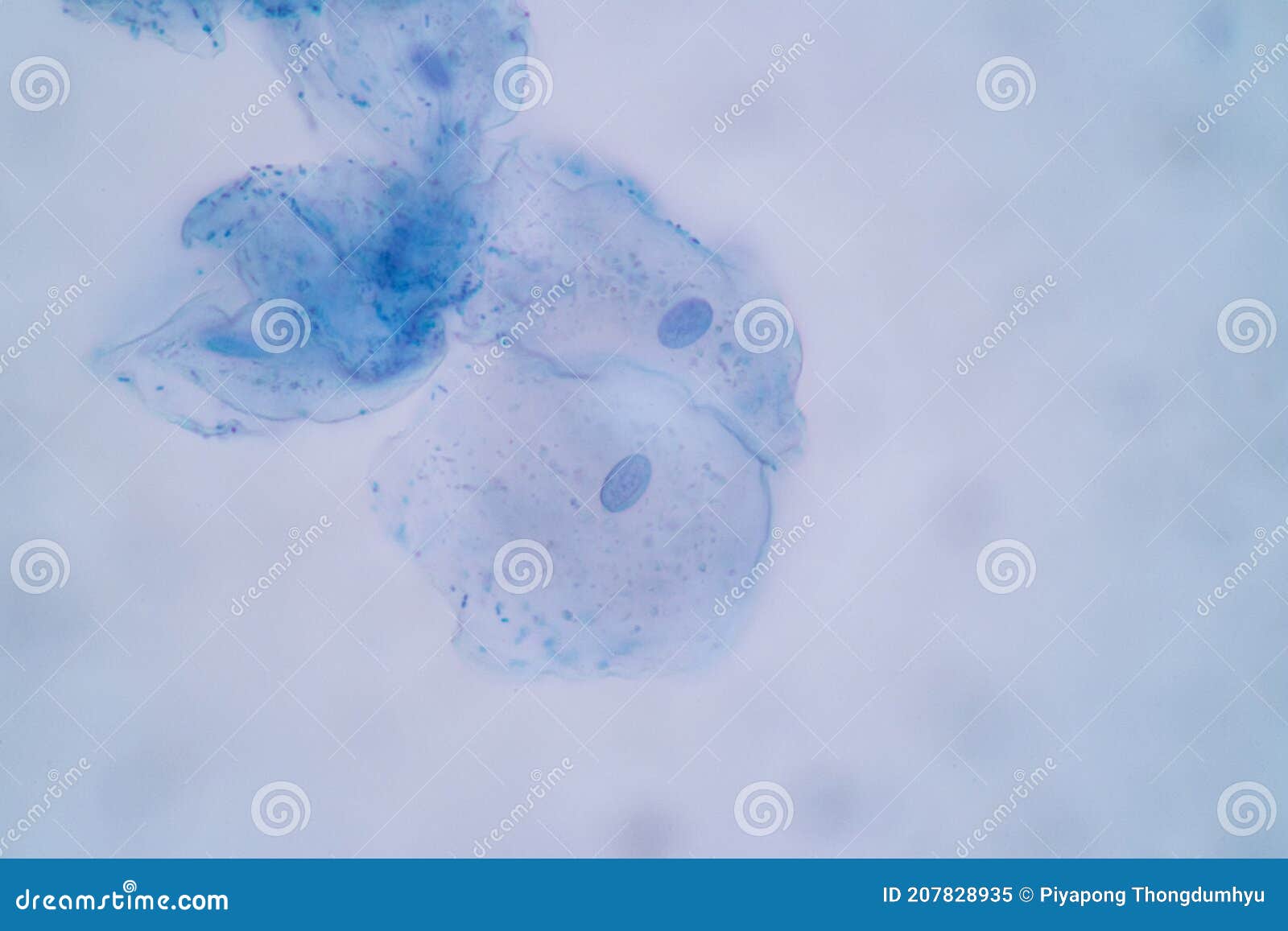Characteristics of Squamous Epithelial Cell Cell Structure of Human ...