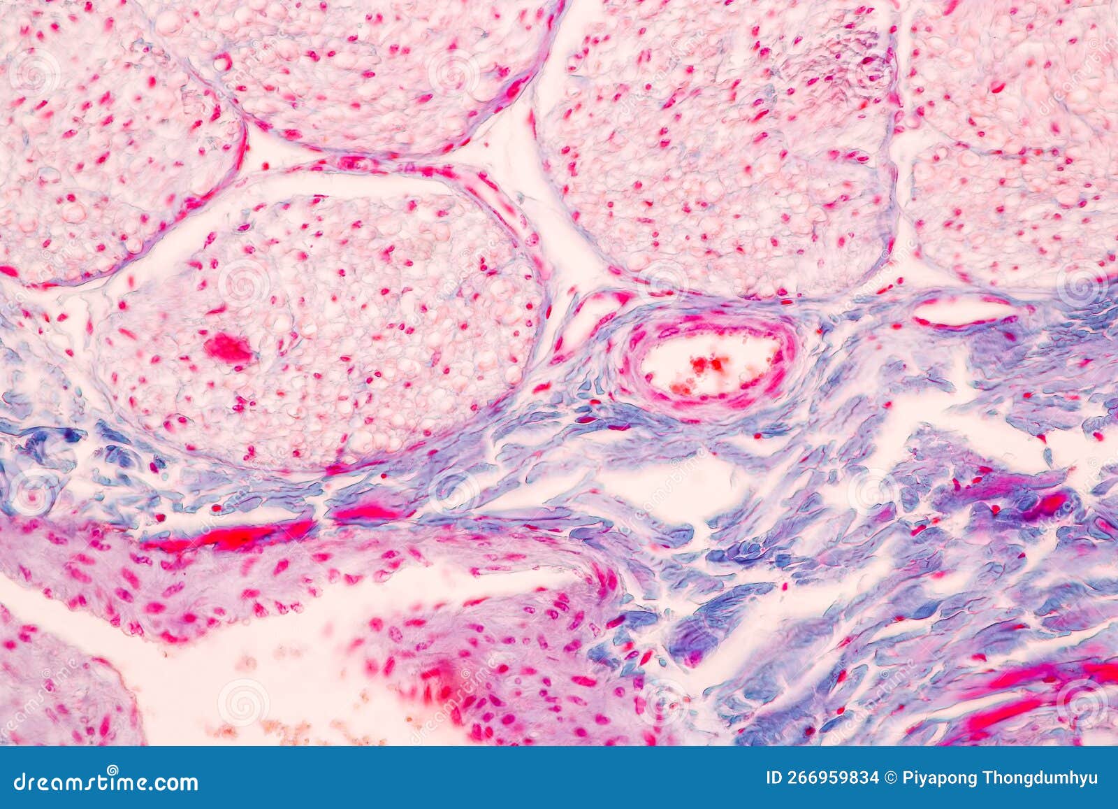 Characteristics Tissue of Olfactory Epithelium Human Under the ...