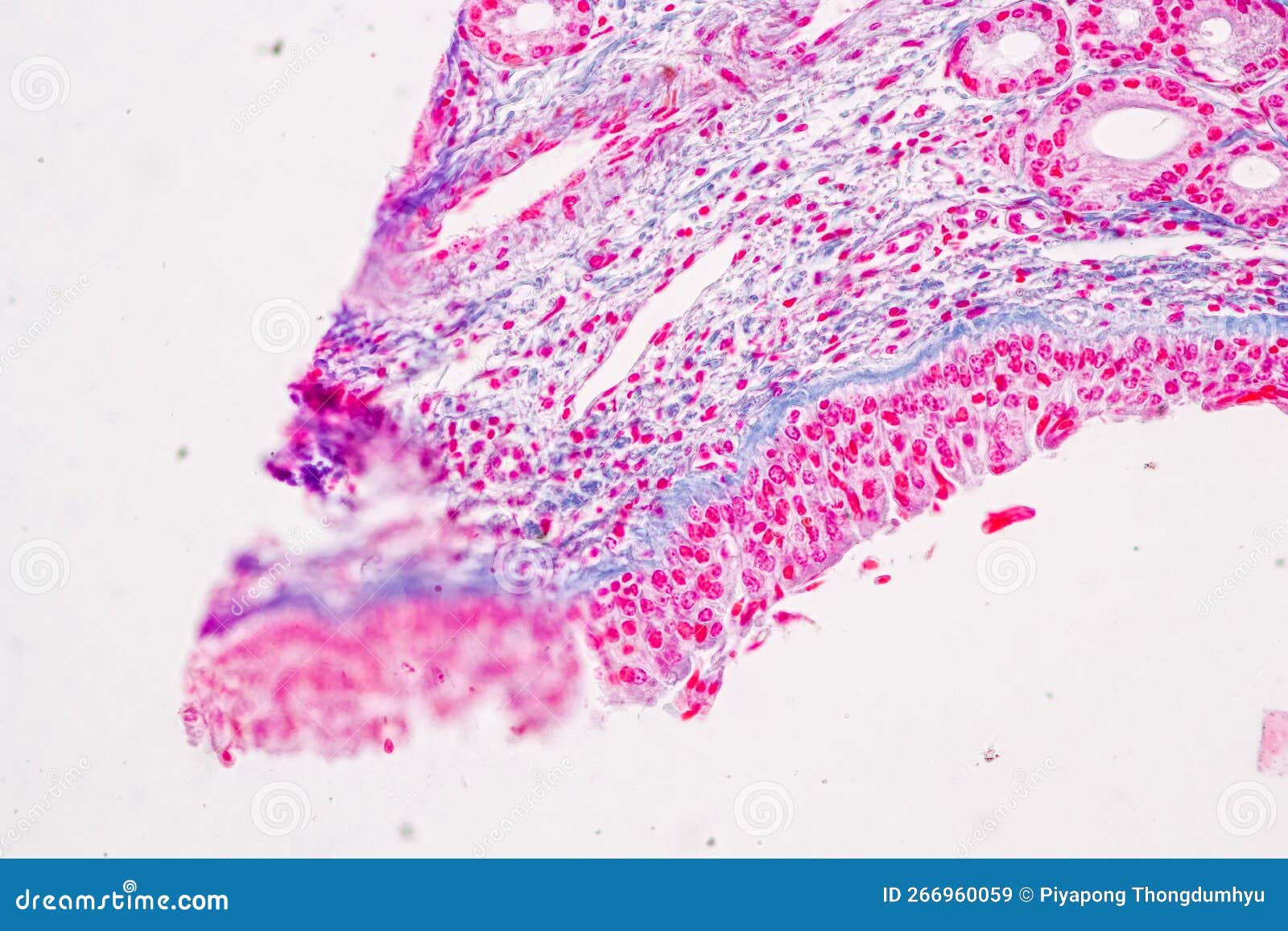 Characteristics Tissue of Olfactory Epithelium Human Under the ...