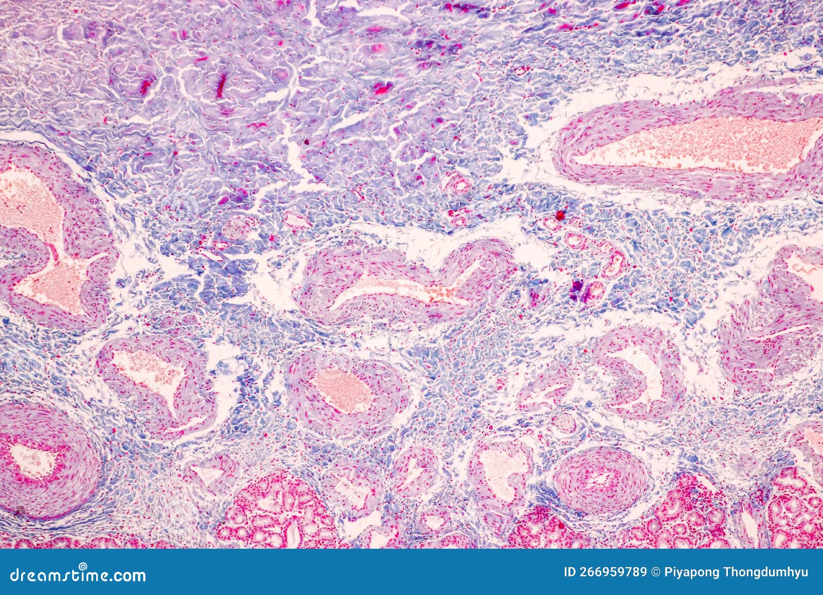 Characteristics Tissue of Olfactory Epithelium Human Under the ...