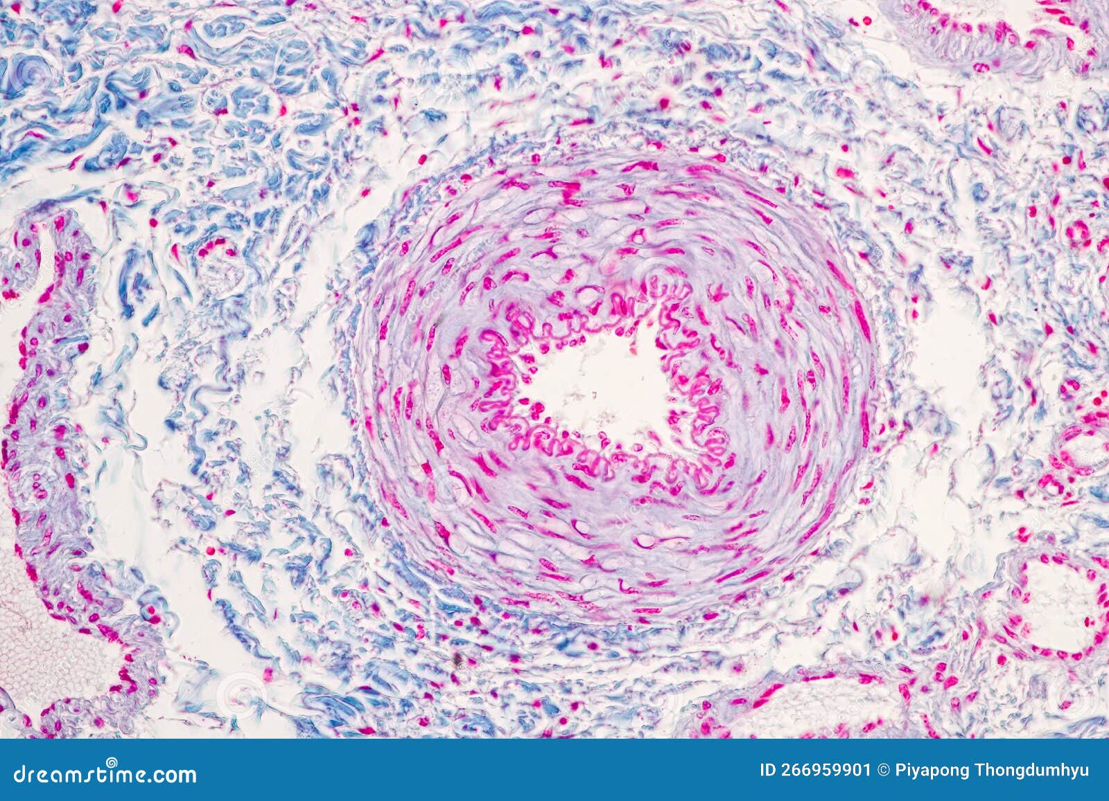 Characteristics Tissue of Olfactory Epithelium Human Under the ...