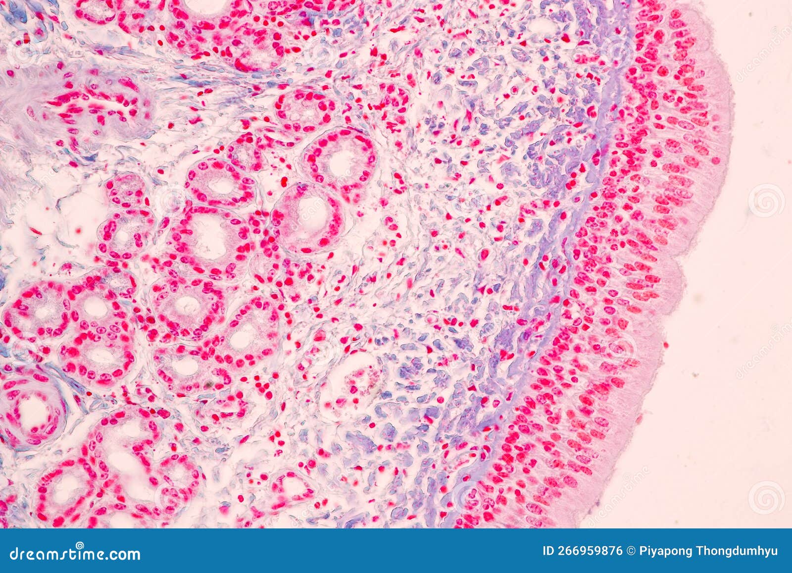 Characteristics Tissue Of Olfactory Epithelium Human Under The ...