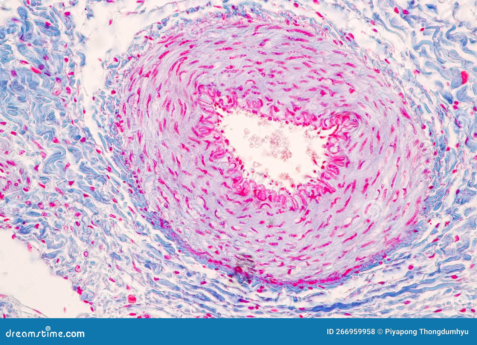 Characteristics Tissue of Olfactory Epithelium Human Under the ...