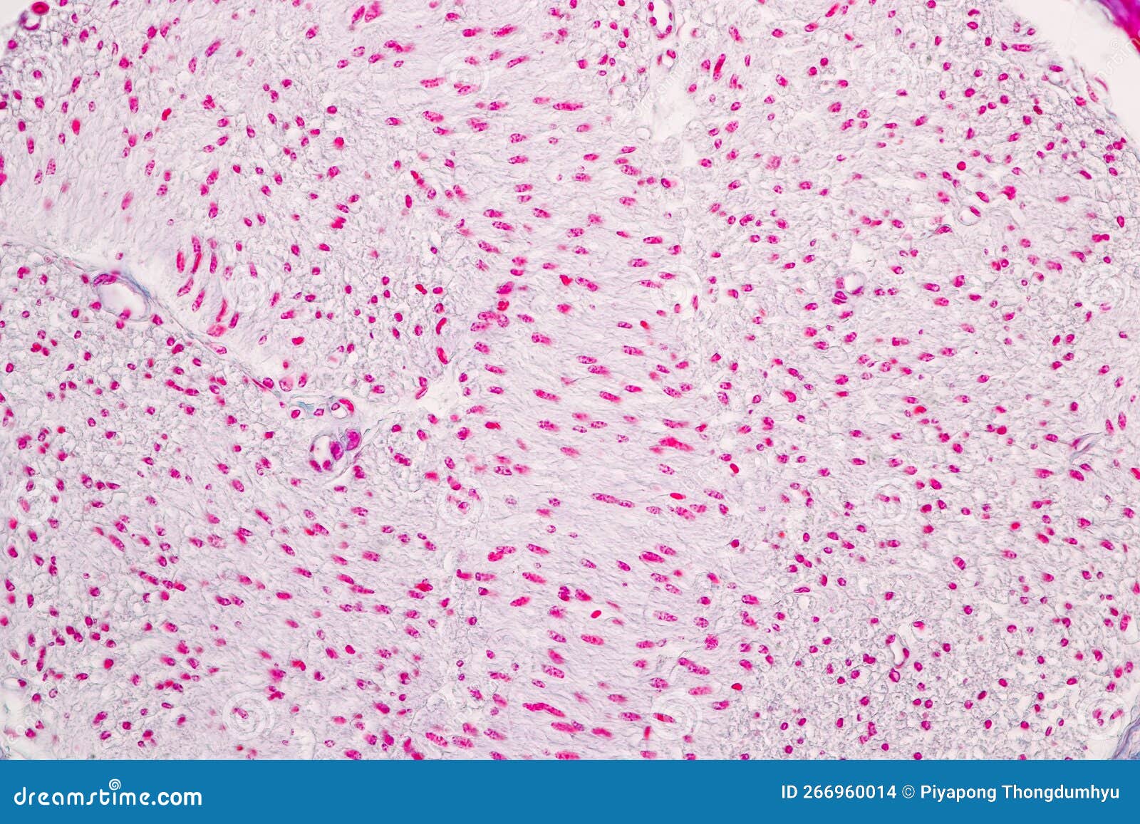 Characteristics Tissue of Olfactory Epithelium Human Under the ...