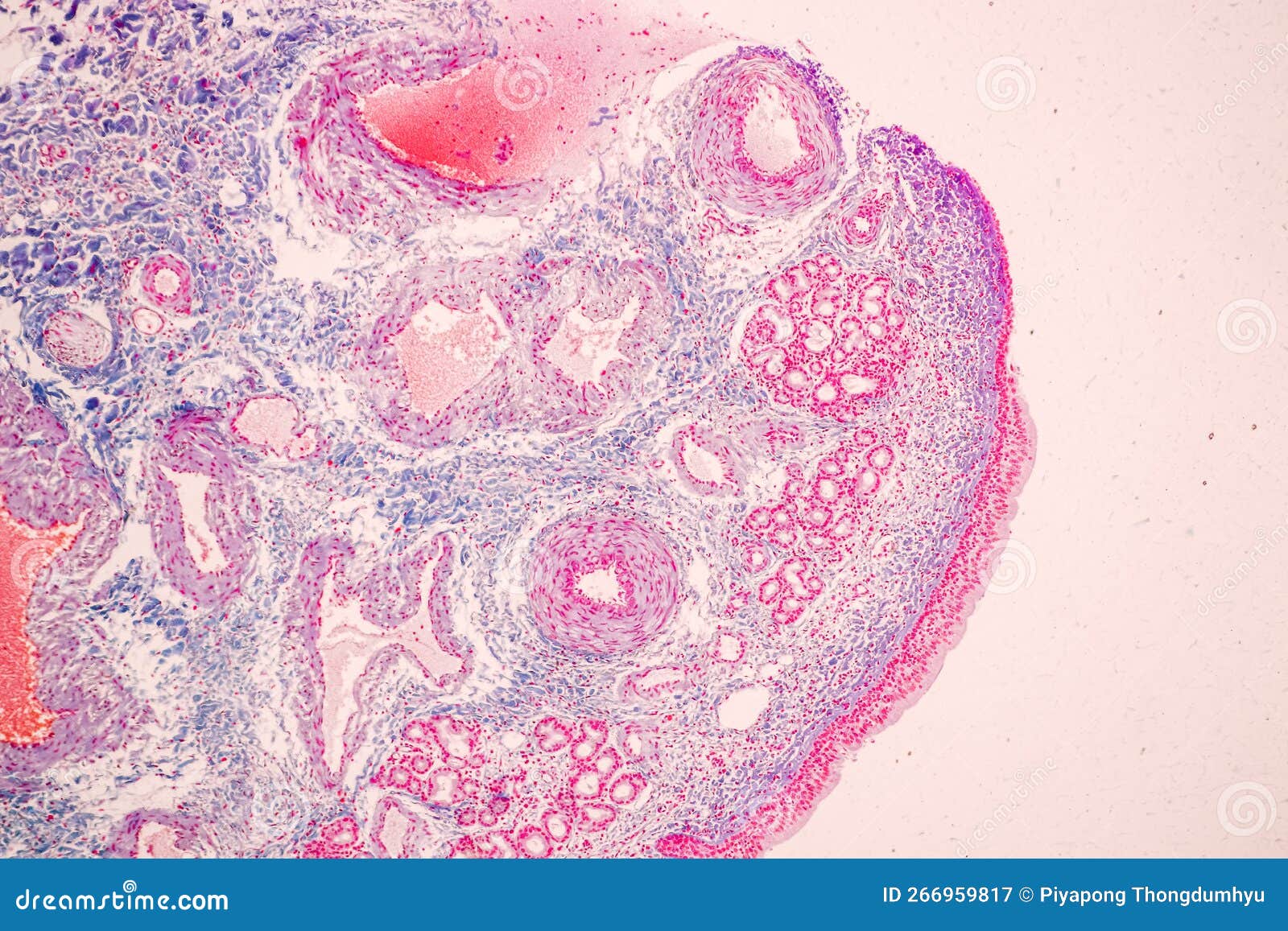 Characteristics Tissue of Olfactory Epithelium Human Under the ...
