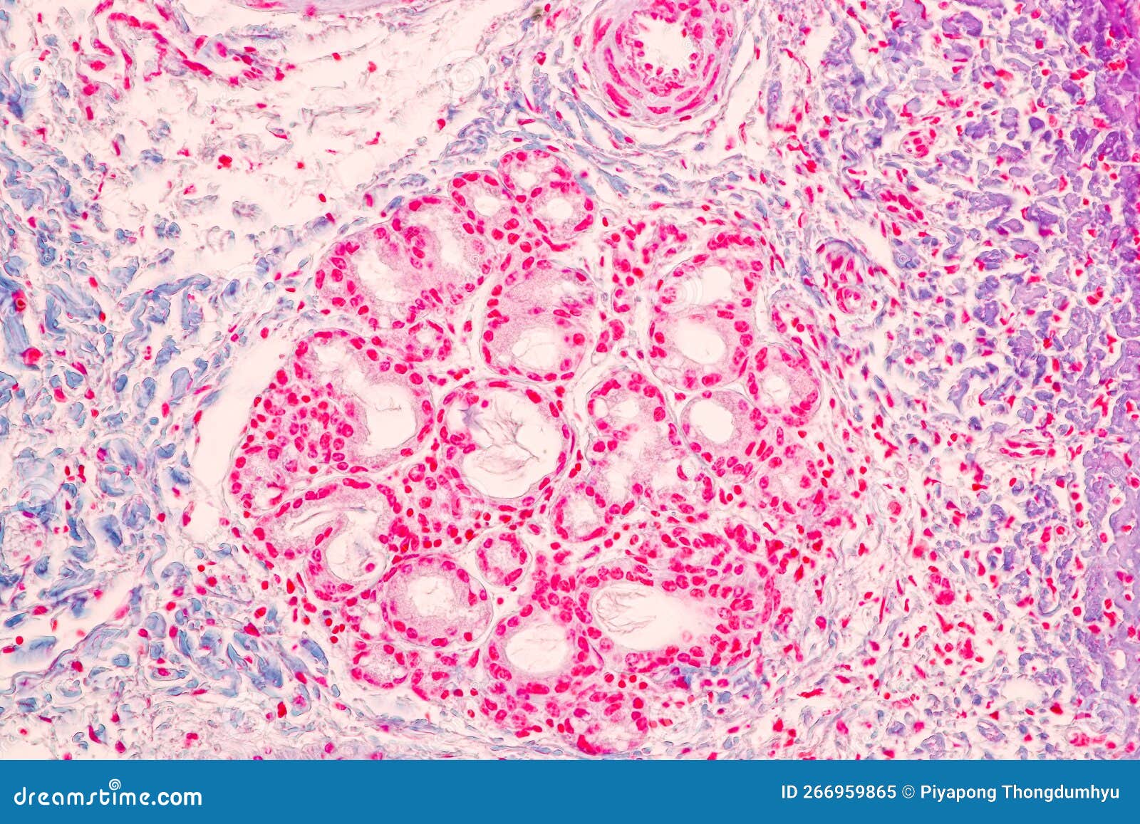 Characteristics Tissue of Olfactory Epithelium Human Under the ...