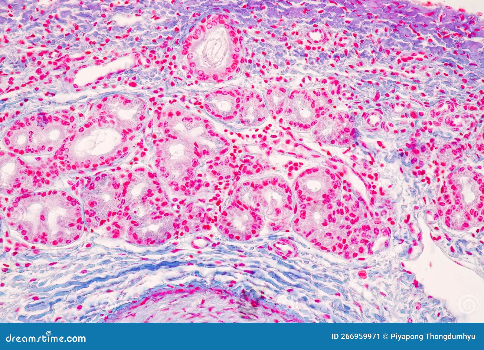 Characteristics Tissue of Olfactory Epithelium Human Under the ...