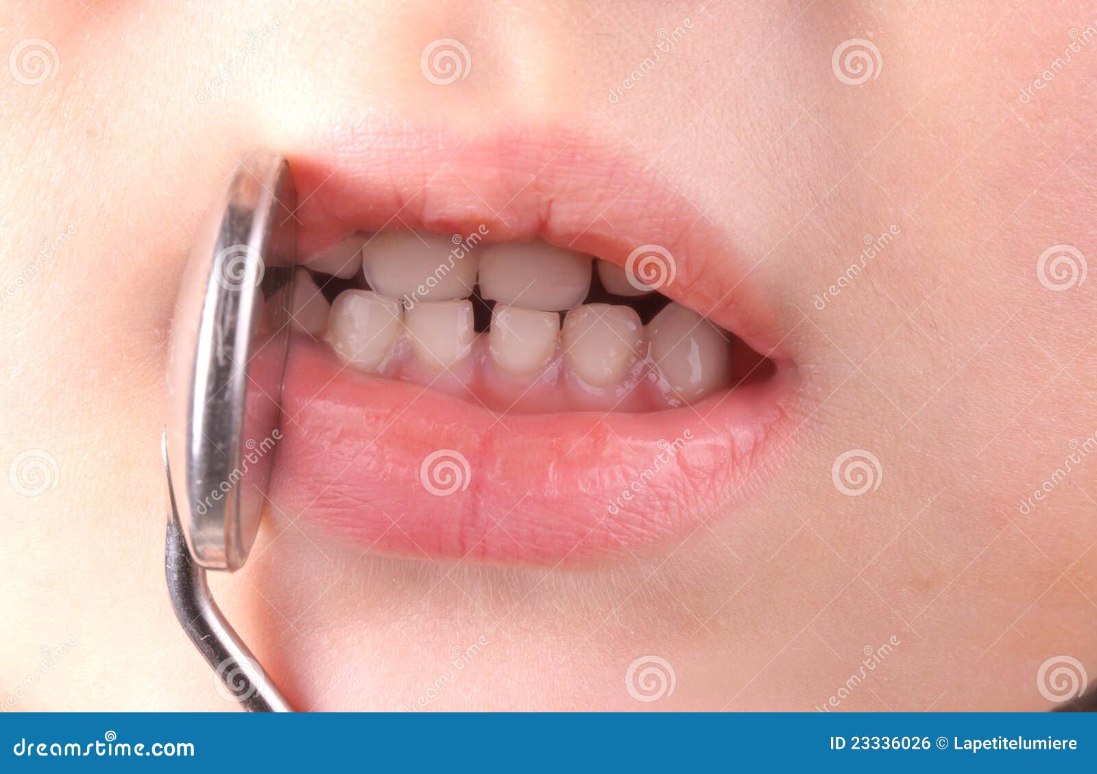 Checking a child s teeth stock photo. Image of look, calm - 23336026