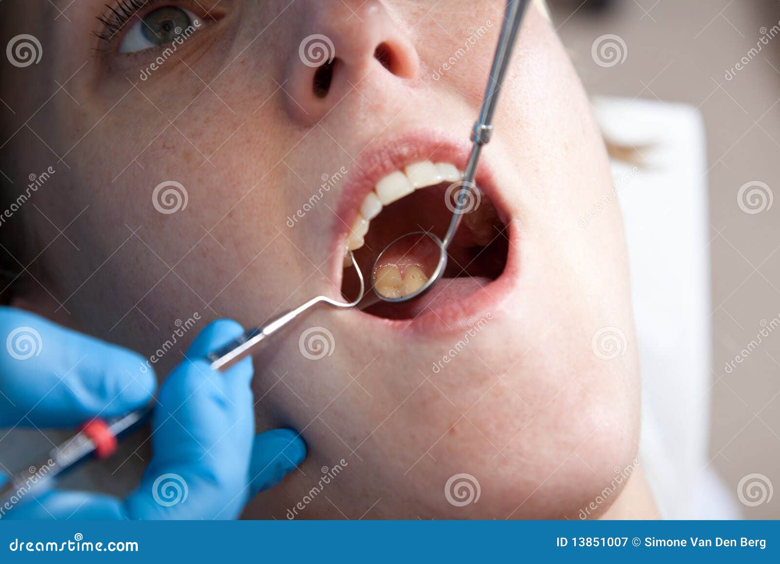 Checking for Dental Cavities Stock Image - Image of care, caucasian ...