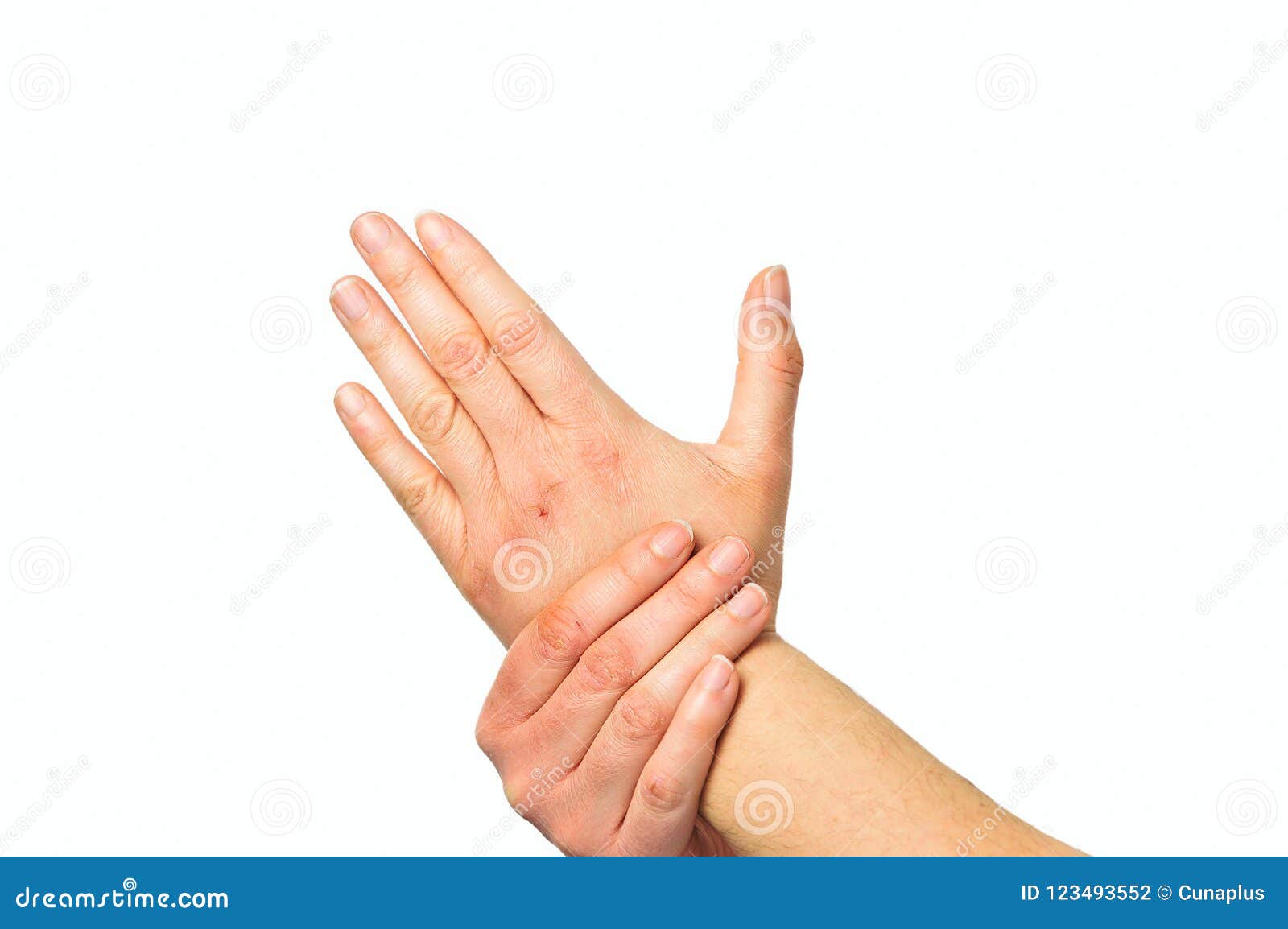 Checking the hand stock photo. Image of aged, dermatology - 123493552