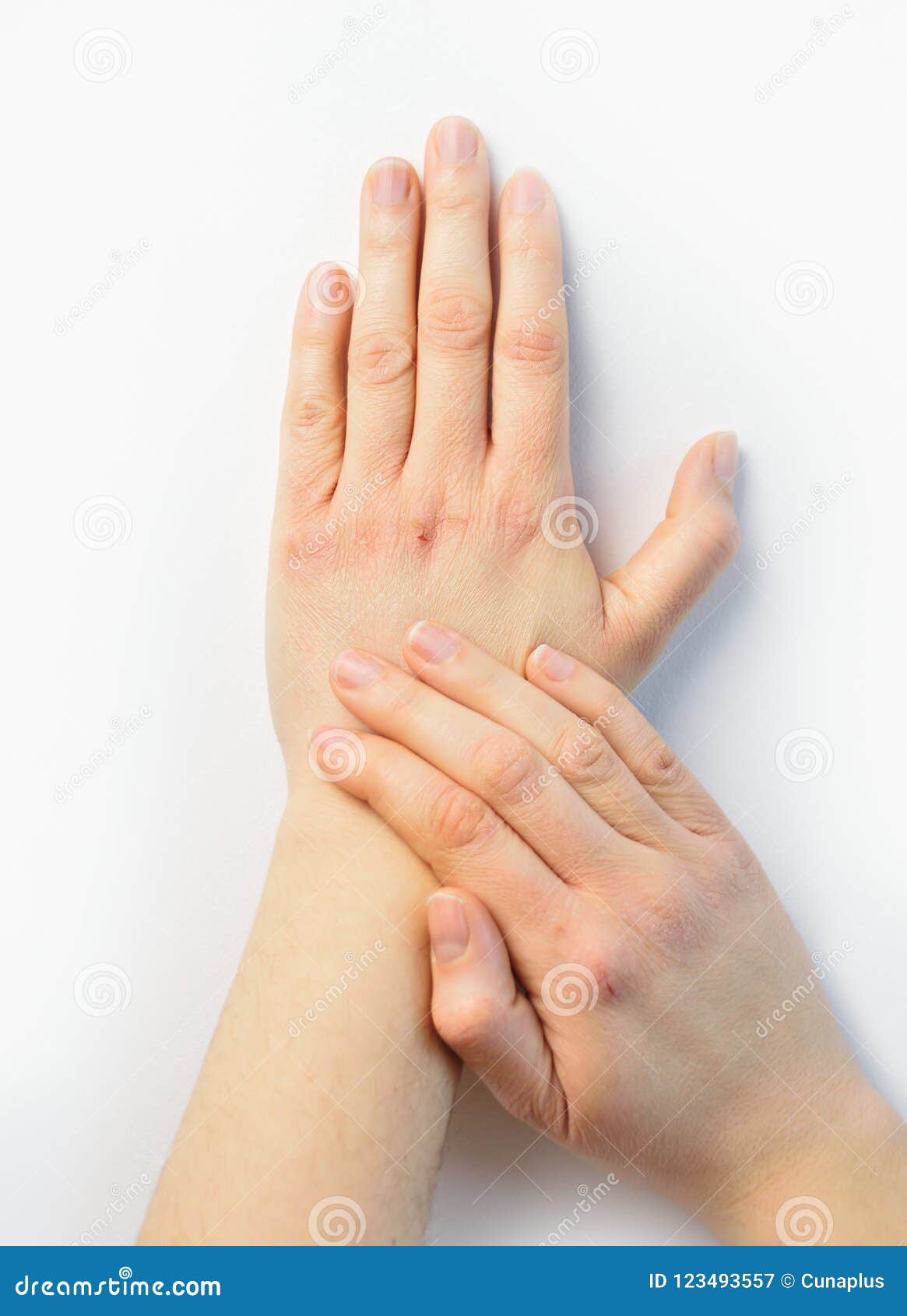 Checking the hand stock image. Image of cracked, damaged - 123493557