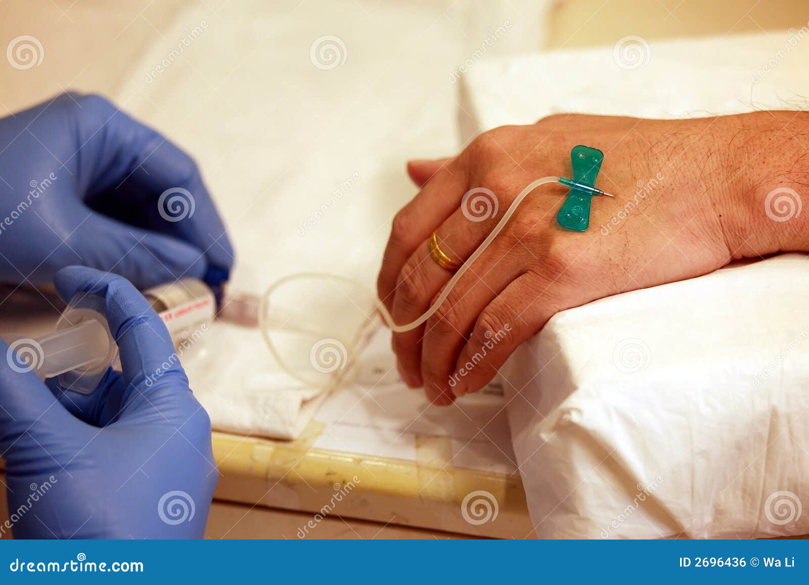 Chemotherapie stockfoto. Bild von neoplasma, feindseligkeit - 2696436