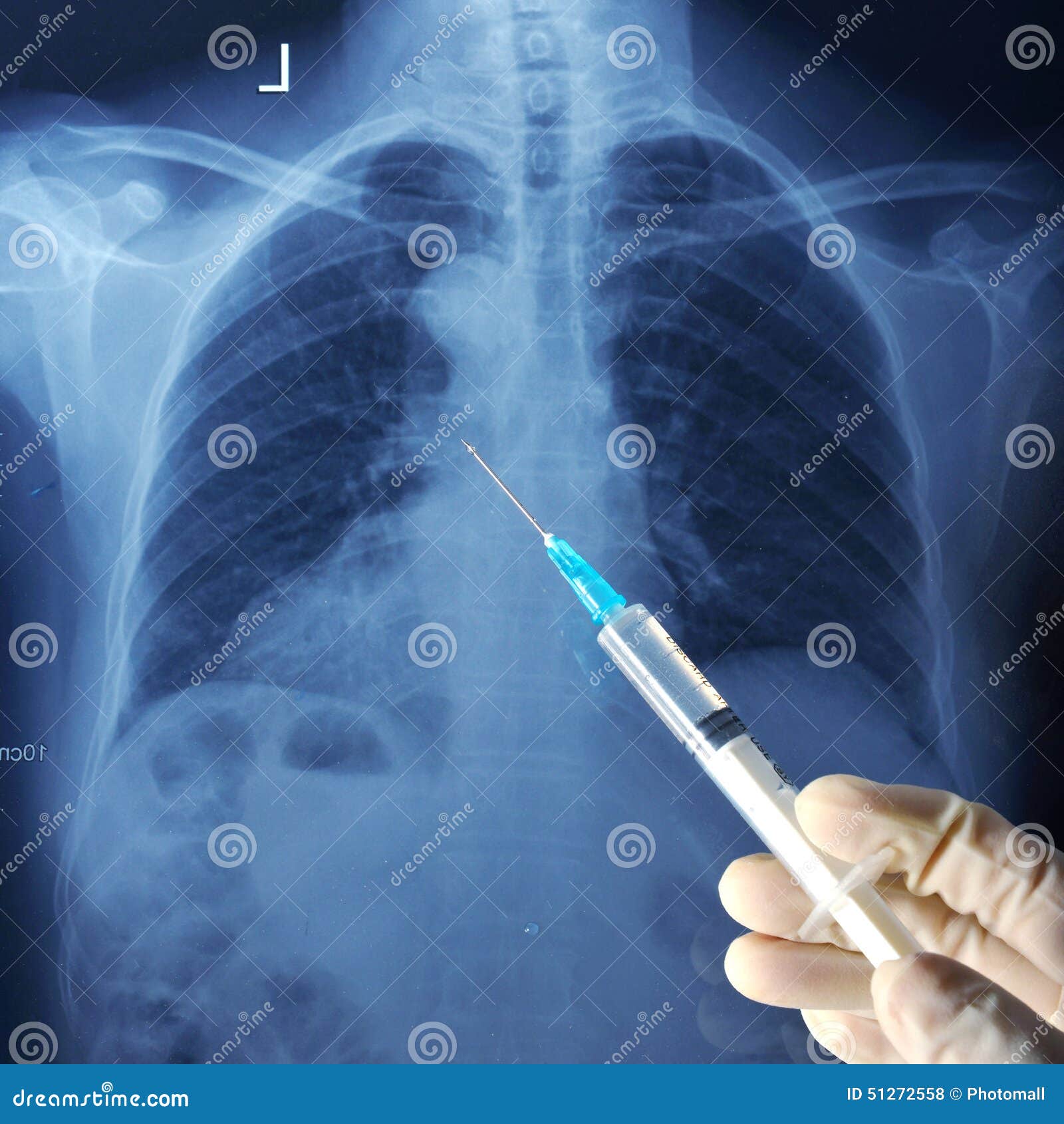 Chest CT scan film syringe stock photo. Image of antibiotic - 51272558