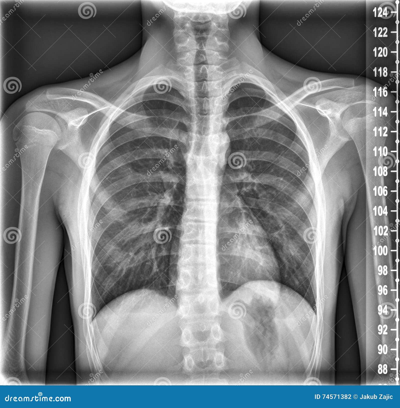 160 Back Lungs View Stock Photos - Free & Royalty-Free Stock Photos ...