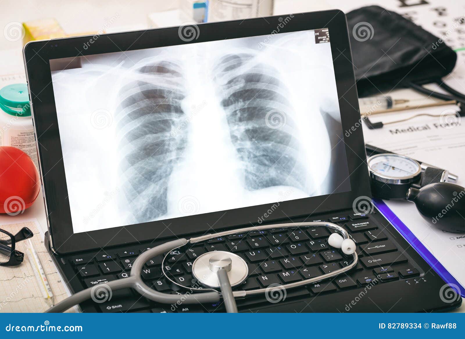 Chest X Ray on a Doctor`s Computer Screen Stock Photo - Image of ...
