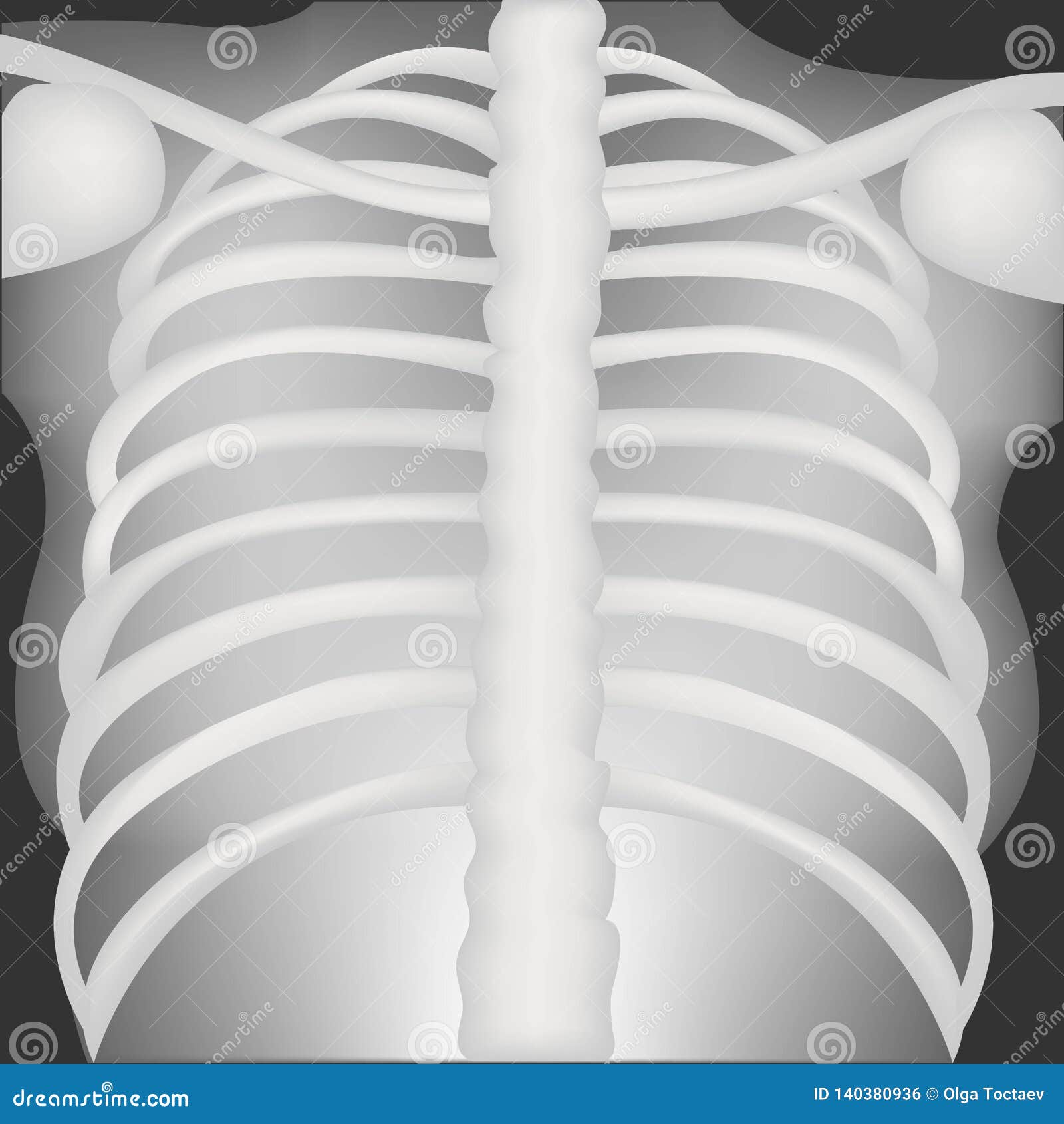Chest X-rays in Upright Position for Medical Study and Learning. Easily ...
