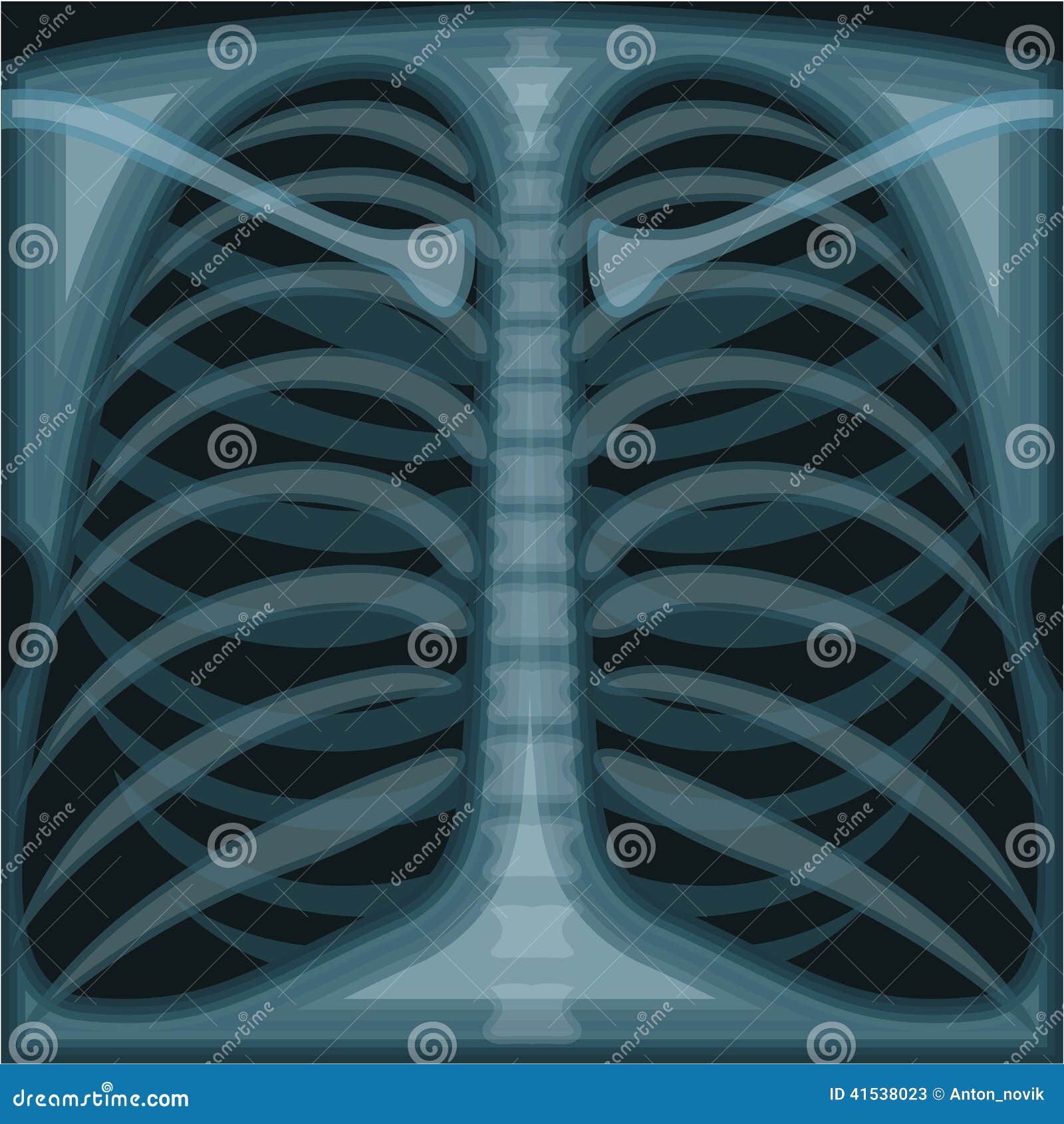 Chest X-ray Stock Vector - Image: 41538023