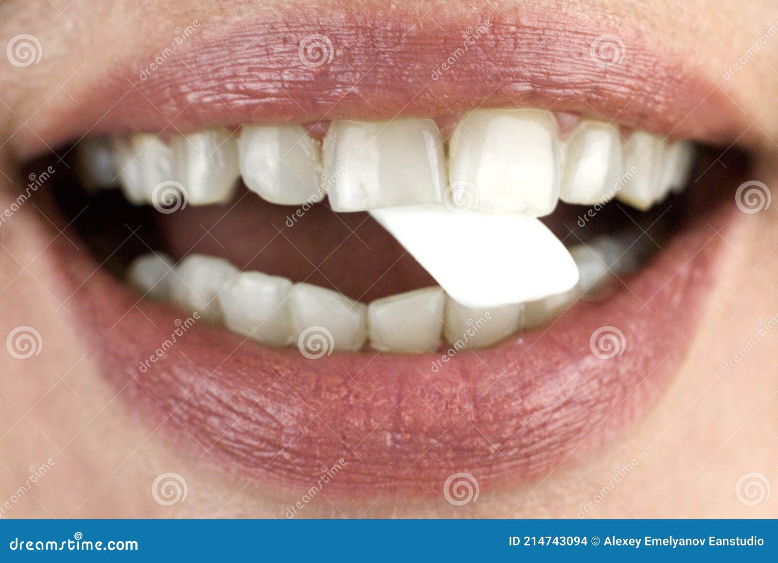 Chewing Gum in a Woman Teeth Stock Photo - Image of chew, cleaning ...