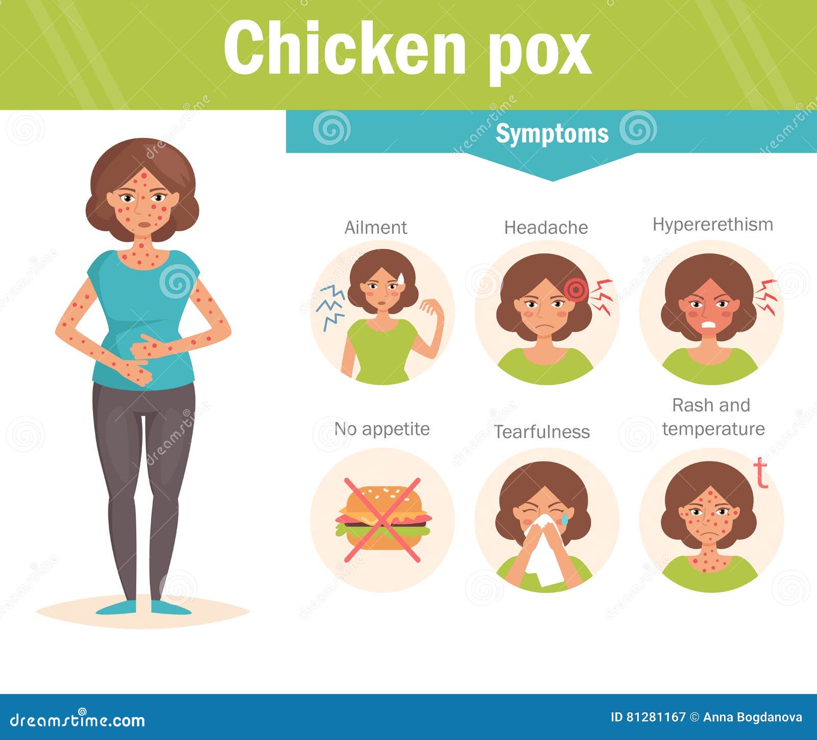 Chicken pox. Vector stock vector. Illustration of measles - 81281167