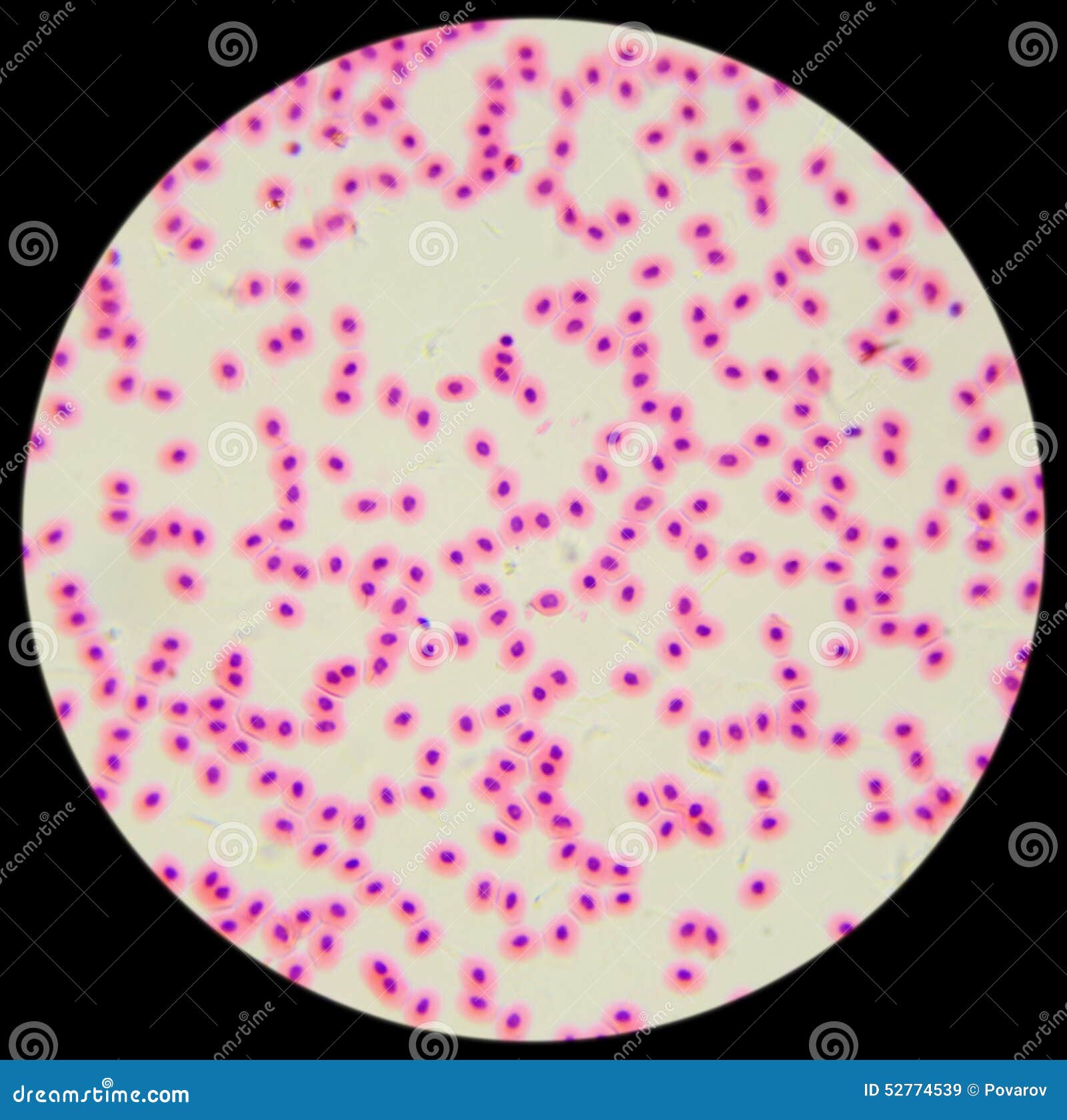 Chicken Red Blood Cells Under A Microscope (blood Smear Chicken ...
