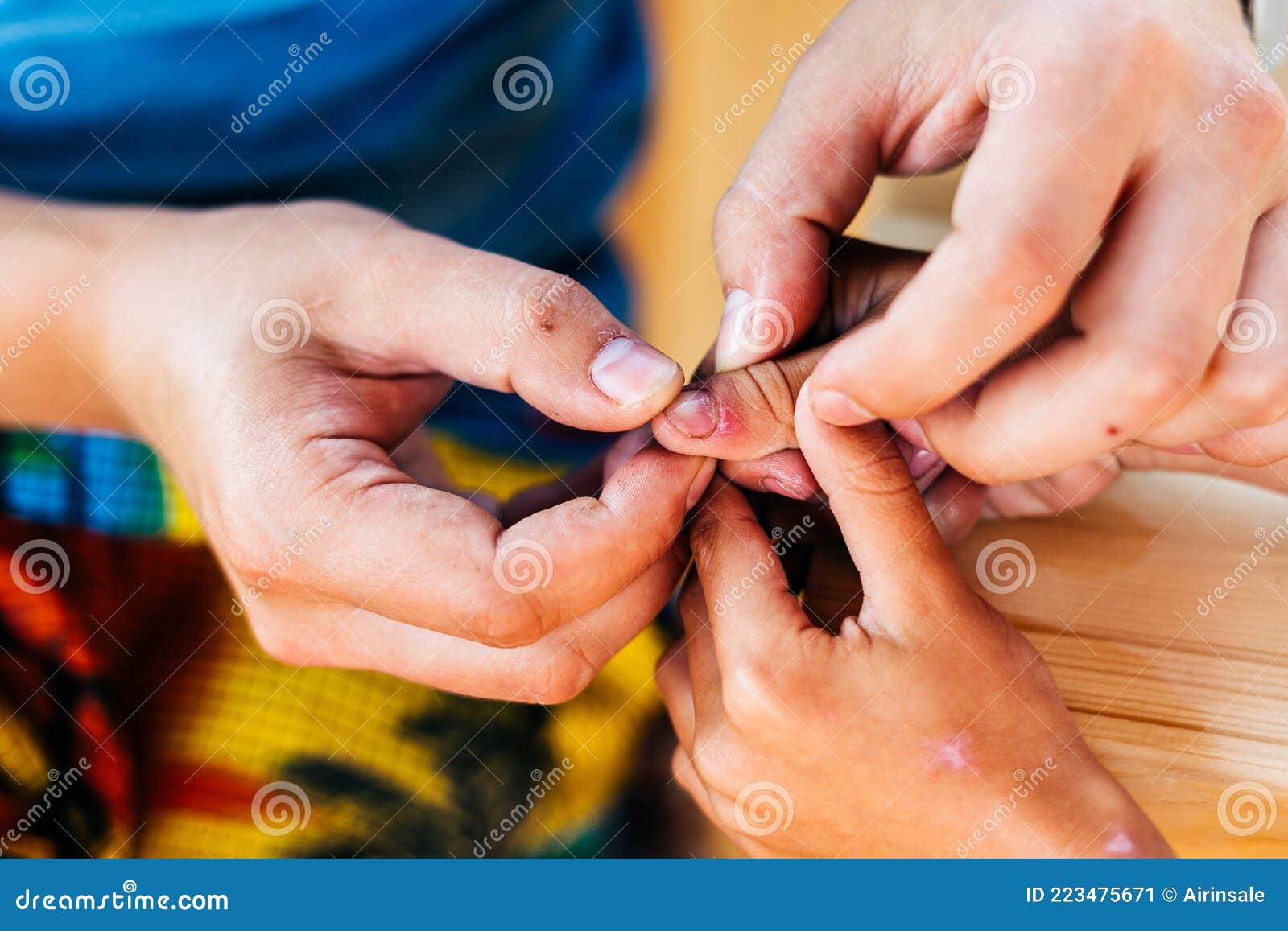 Child Boy Injuring His Hand. Father Provides First Aid. Stock Image ...