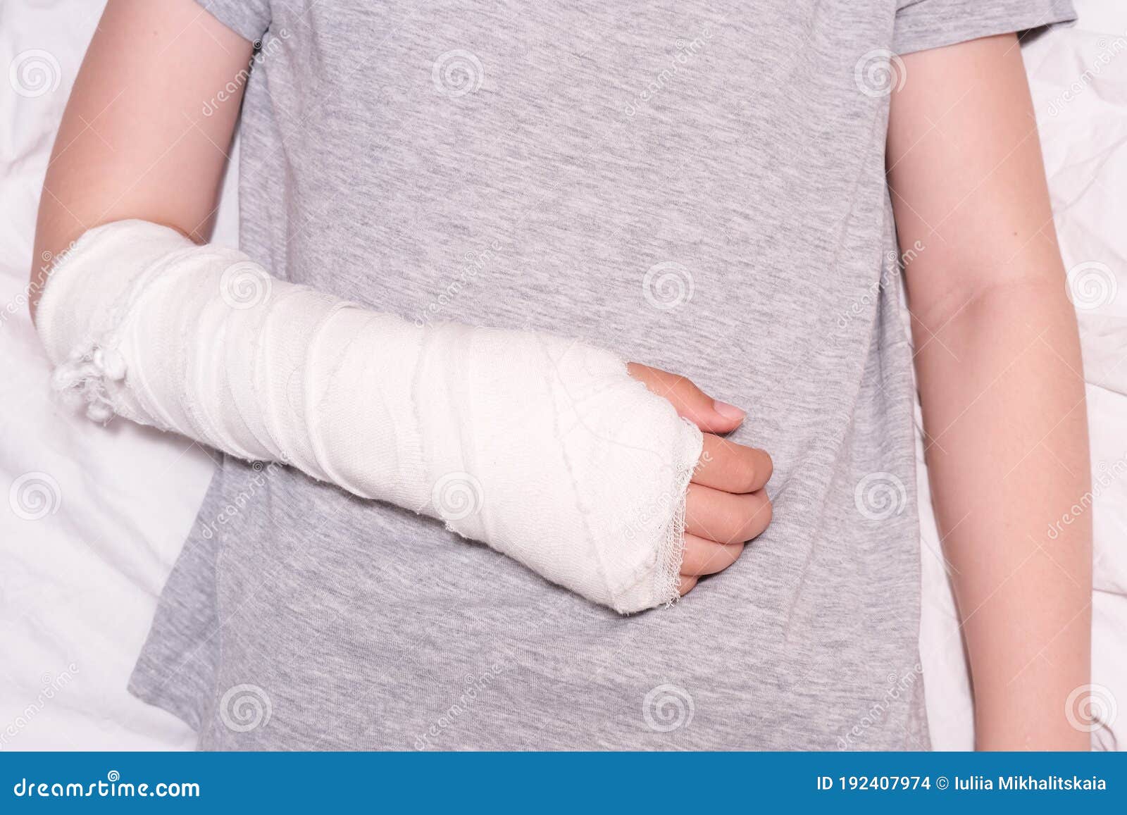 A Child Broken Arm in Plaster Case, Hand Injury because of Accident ... A Child Broken Arm in Plaster Case, Hand Injury because of Accident ...