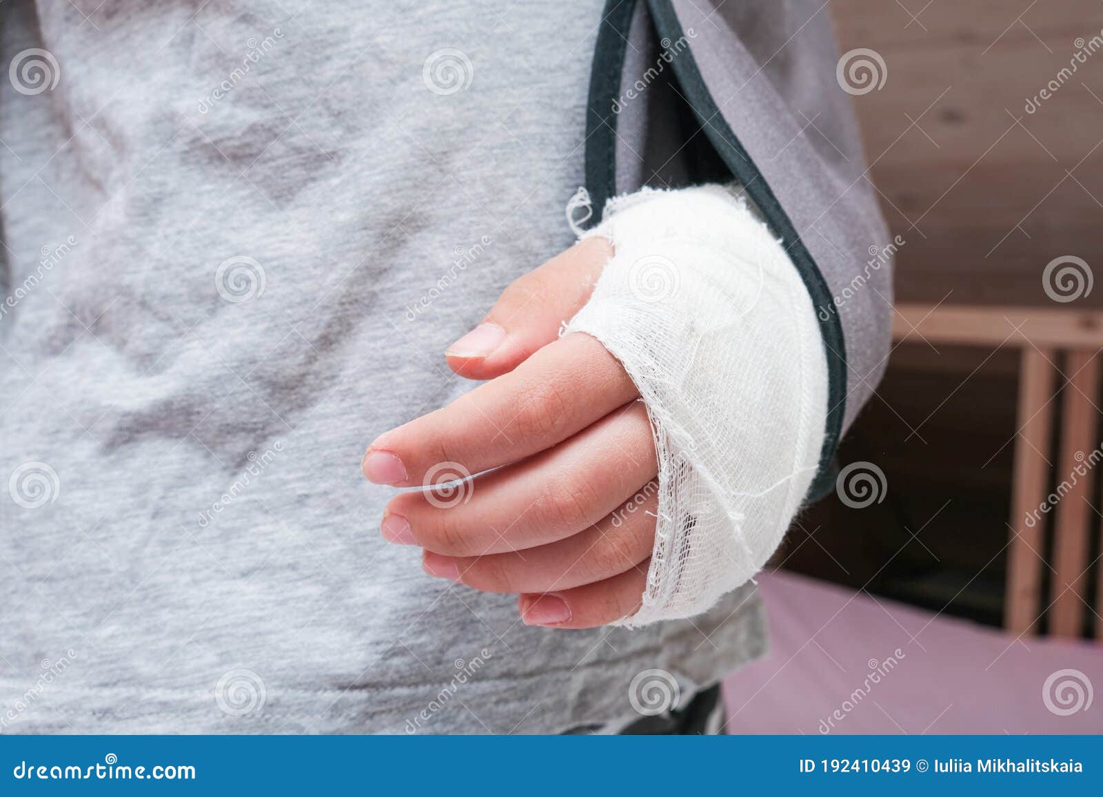 A Child Broken Arm in Plaster Case and Textile Fixing Bandage, Hand ... A Child Broken Arm in Plaster Case and Textile Fixing Bandage, Hand ...